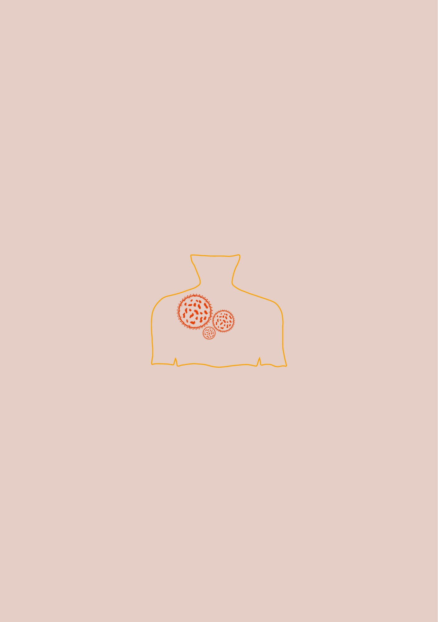 Congenital Melanocytic Naevus · Define, Giant Features, Management