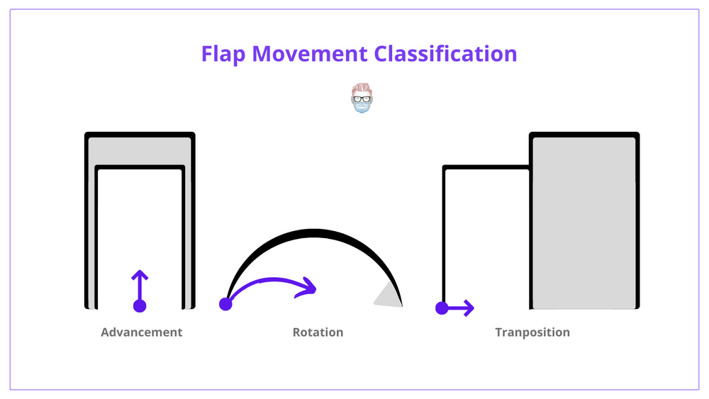 Types & Classification of Flaps