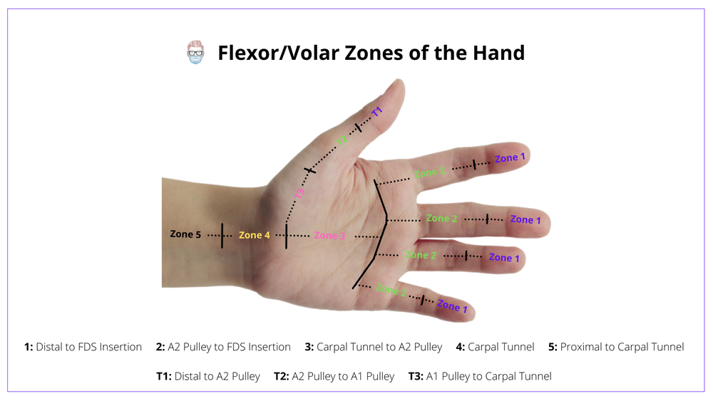 Zones of the Hand (Flexor and Extensor)