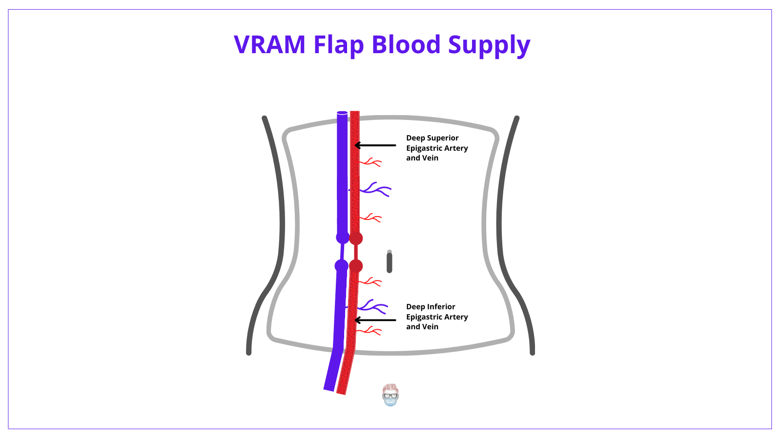 VRAM Flap - Indications, Anatomy, Technique (+ Images)