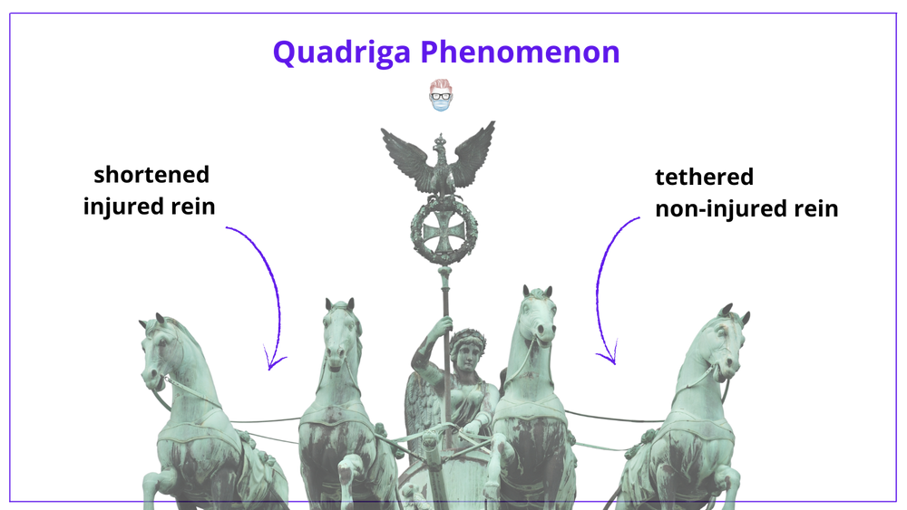 Quadriga Phenomenon