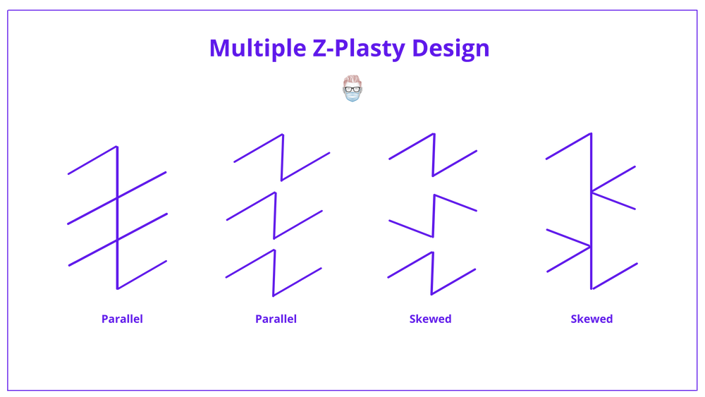 Z-Plasty: Designs, Indications, Variations and Complications