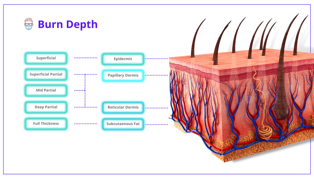 Burn Depth - Classification, Assessment, Characteristics.