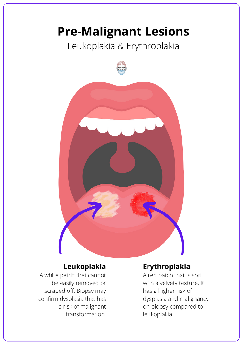 Oral Cavity Tumours: Types, Staging, Treatment, & Anatomy