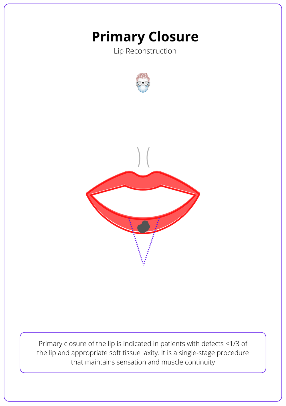 Lip Reconstruction: Anatomy, Indications, & Algorithm