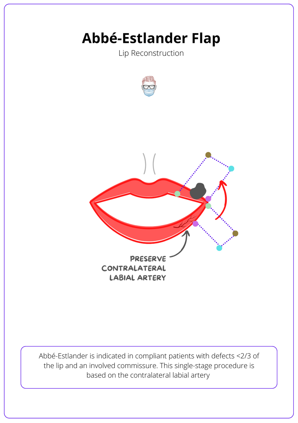 Lip Reconstruction: Anatomy, Indications, & Algorithm
