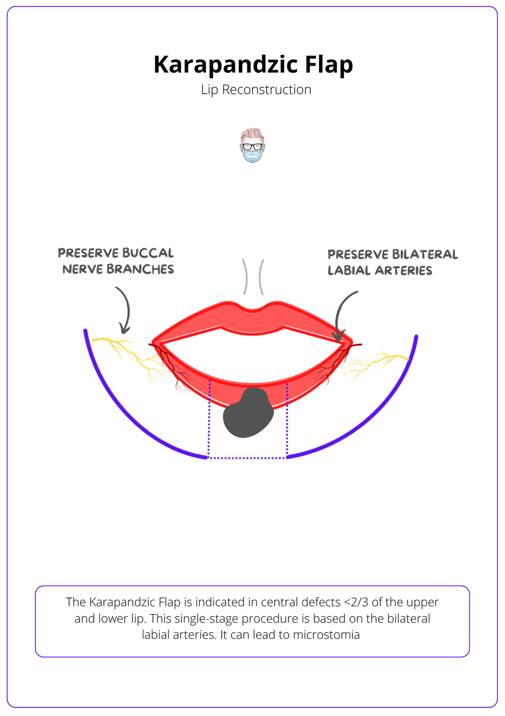 Lip Reconstruction: Anatomy, Indications, & Algorithm