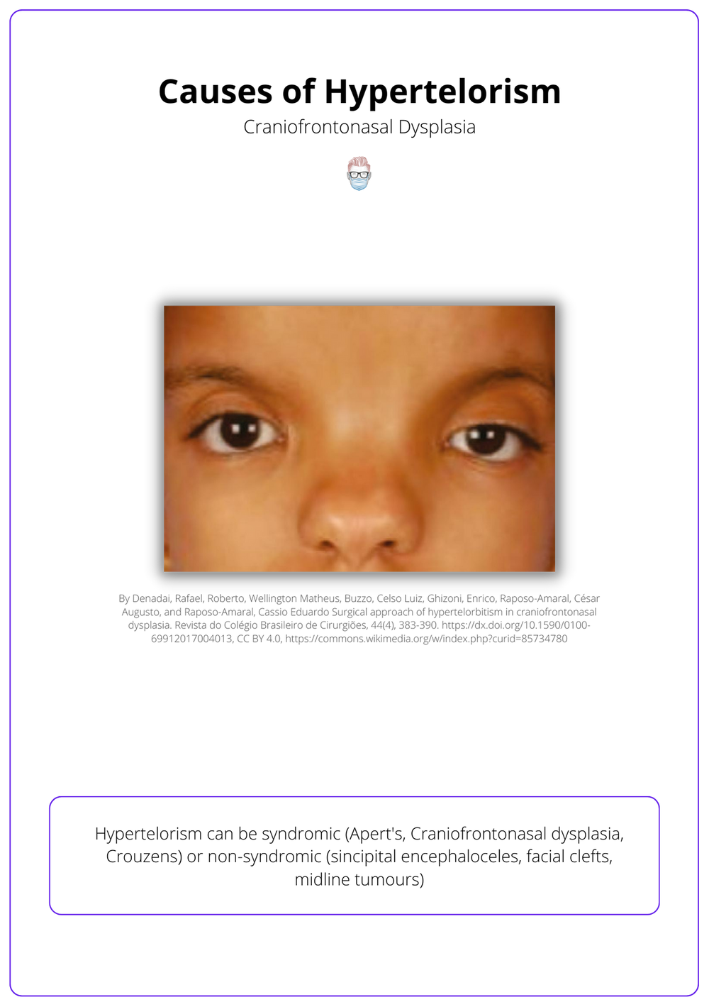 Hypertelorism: Definition, Classifying, Causes, & Treatment