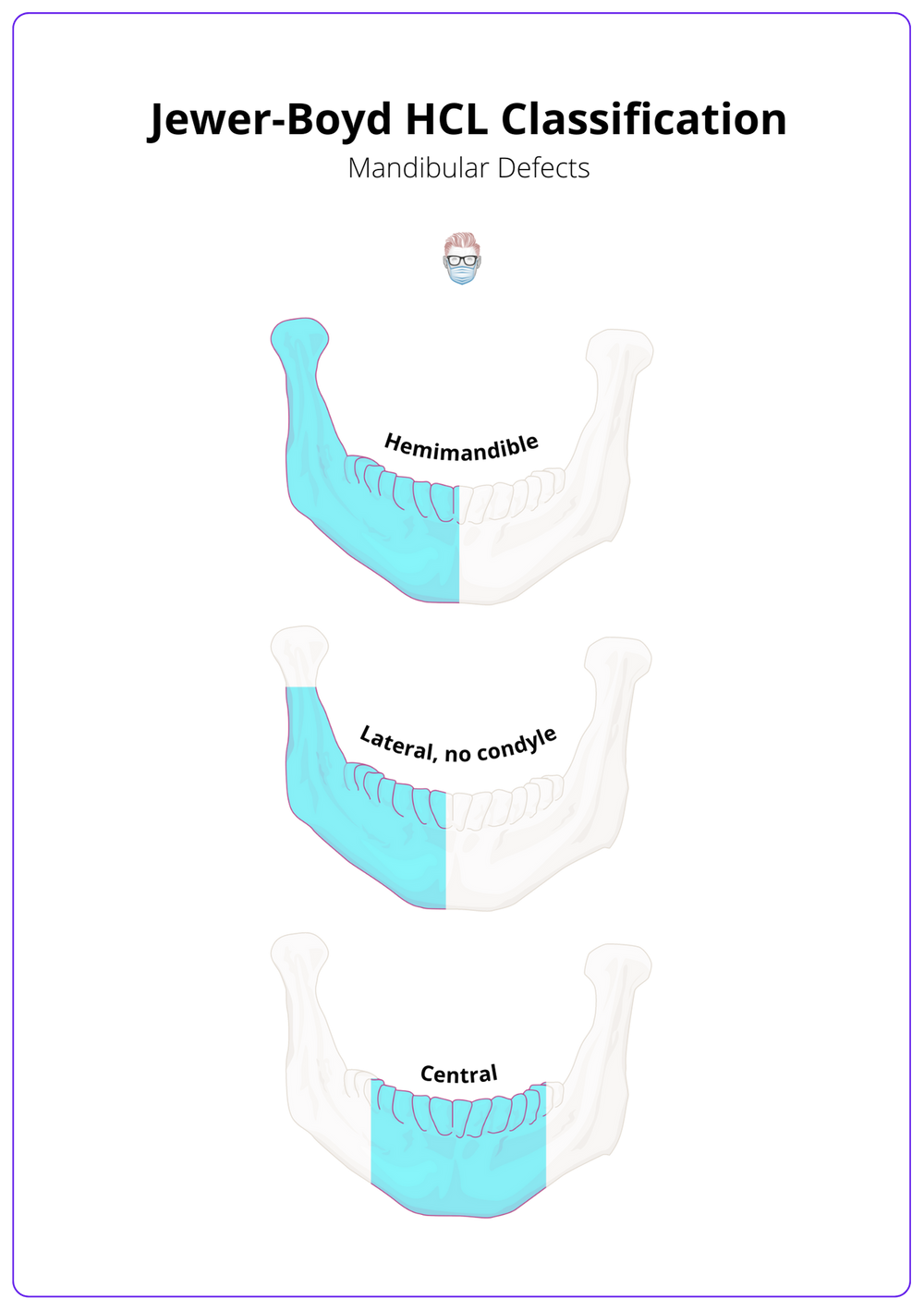 Mandibular Defects: Classification & Reconstruction