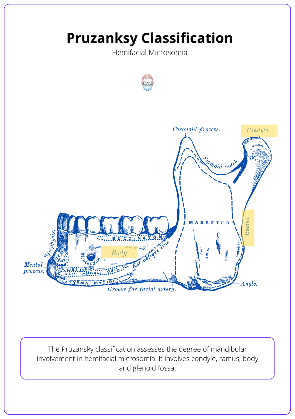 Hemifacial Microsomia: Definition, Classification, & Treatment