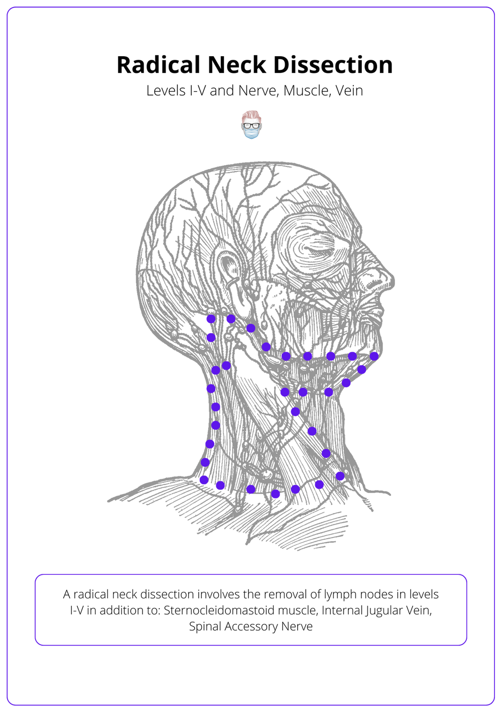 Neck Dissection: Types, Anatomy, Indications, Complications