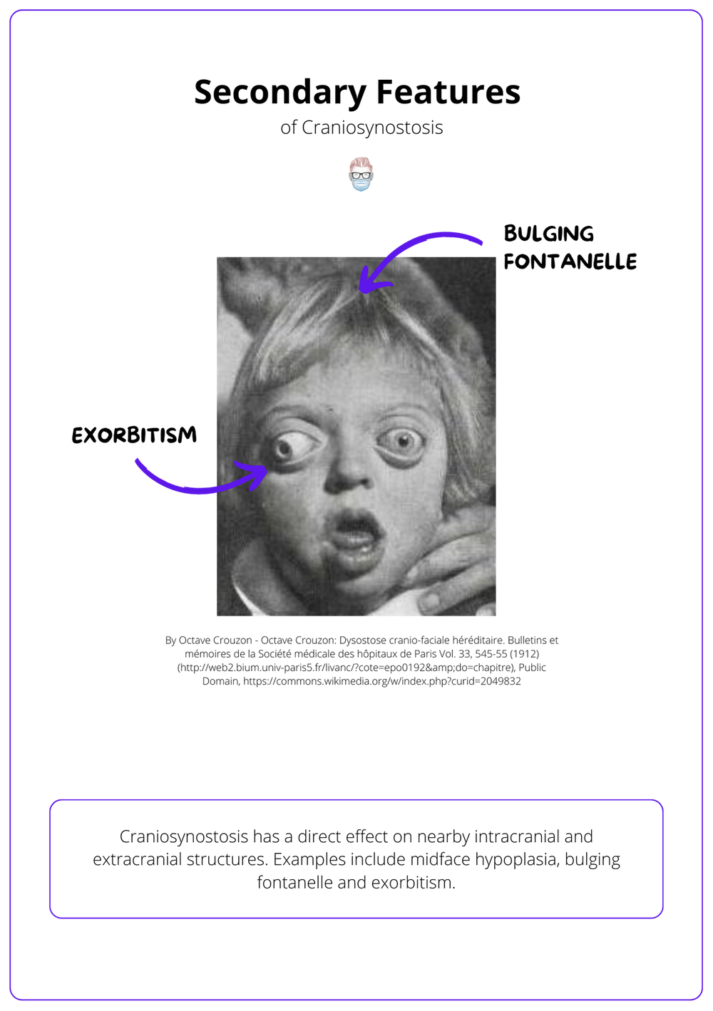 Craniosynostosis: Anatomy, Classification, & Investigations