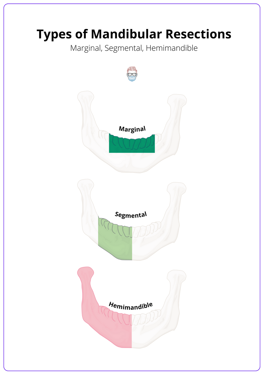 Mandibular Defects: Classification & Reconstruction