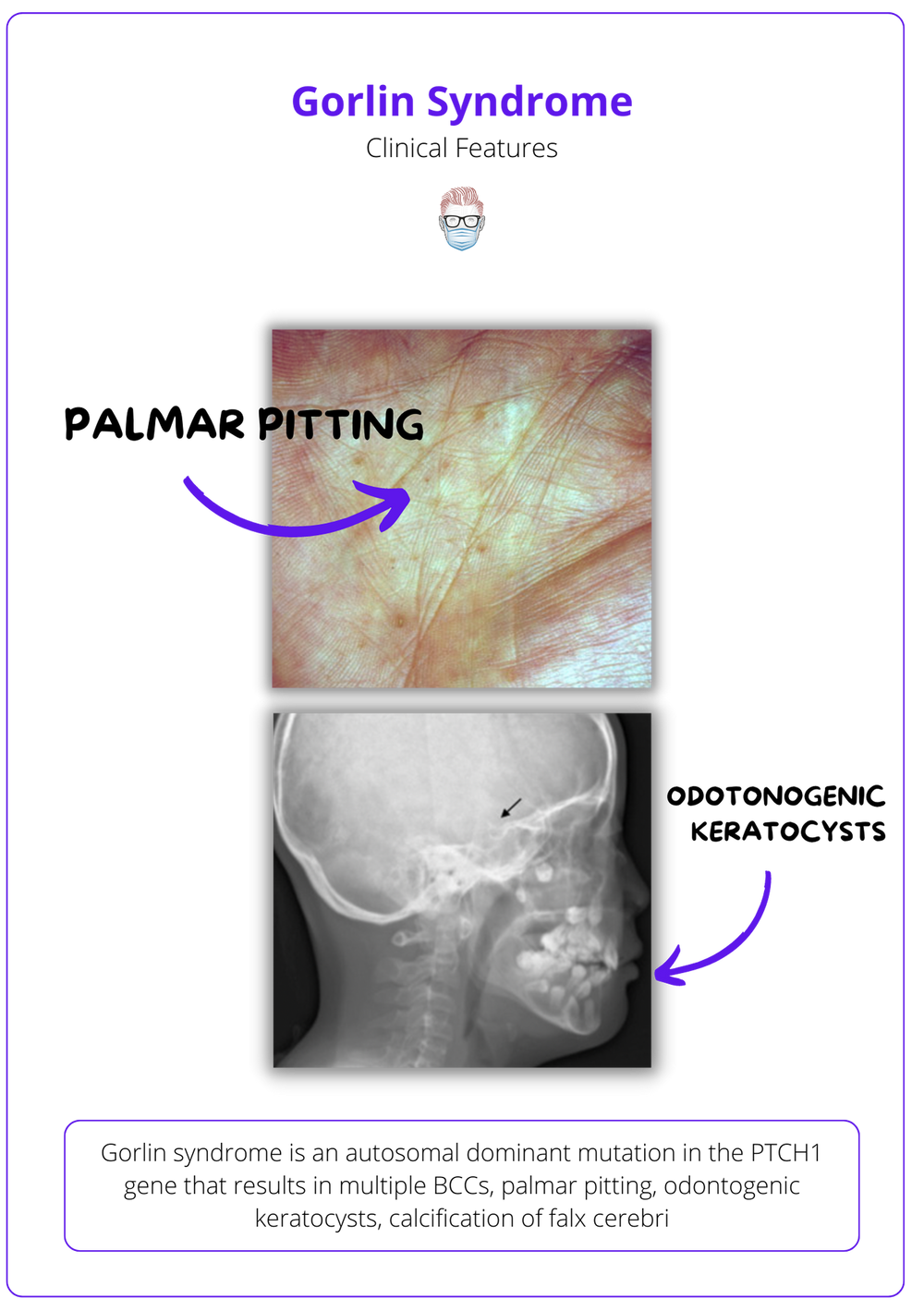 Basal Cell Carcinoma (BCC) · Aetiology, Diagnose, Treat, Follow-up