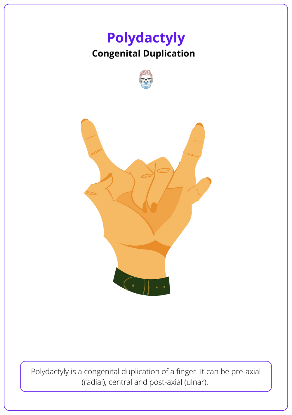 Polydactyly: Classification & Treatment