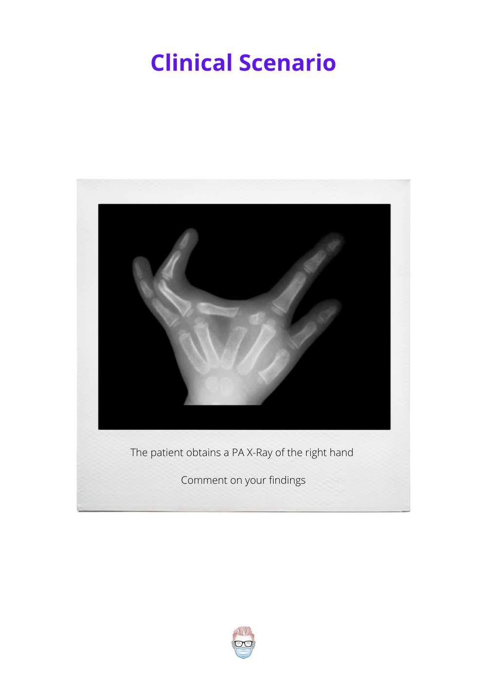 Cleft Hand - Clinical Case