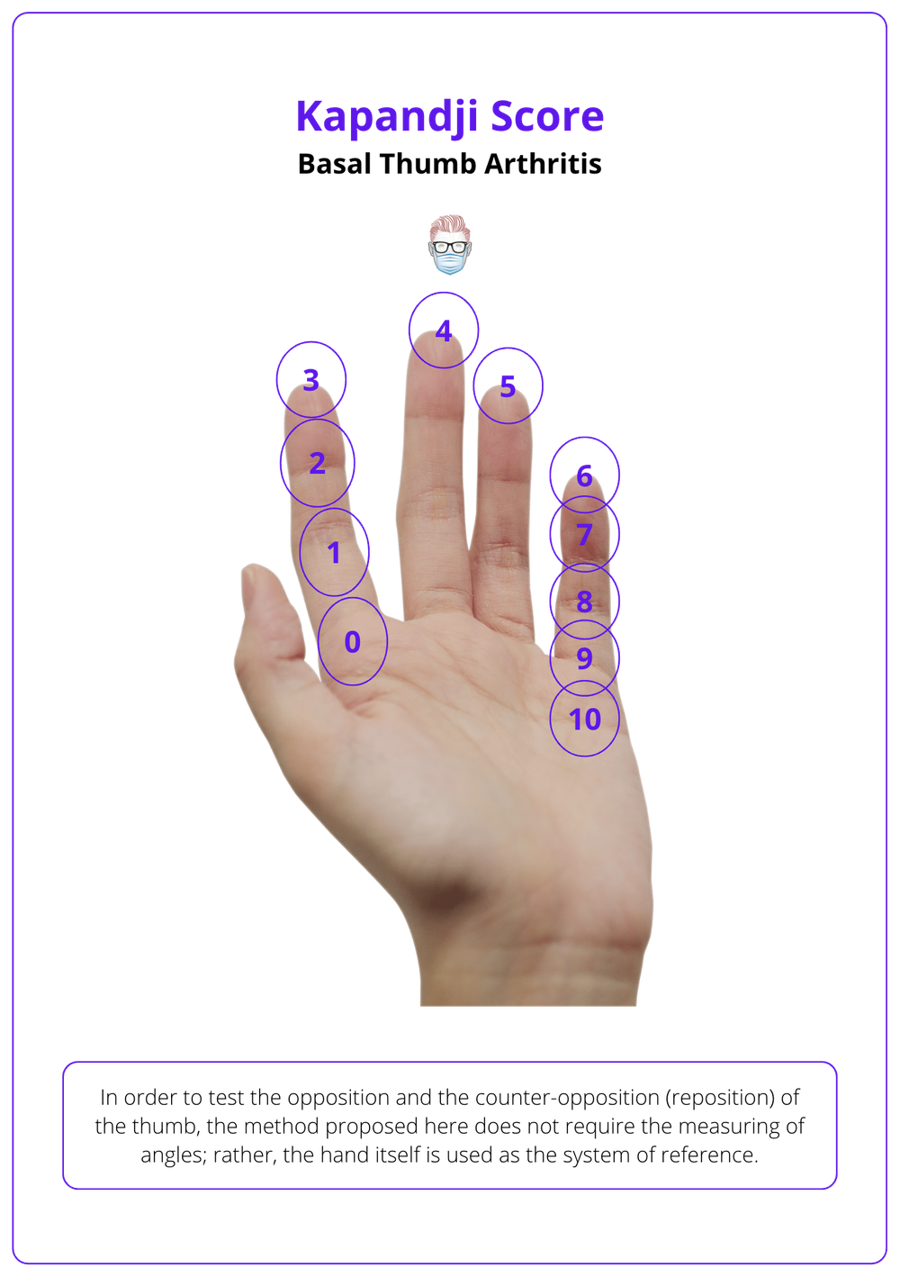 Basal Thumb Osteoarthritis: Anatomy, Pathophysiology, Diagnosis, Treatment