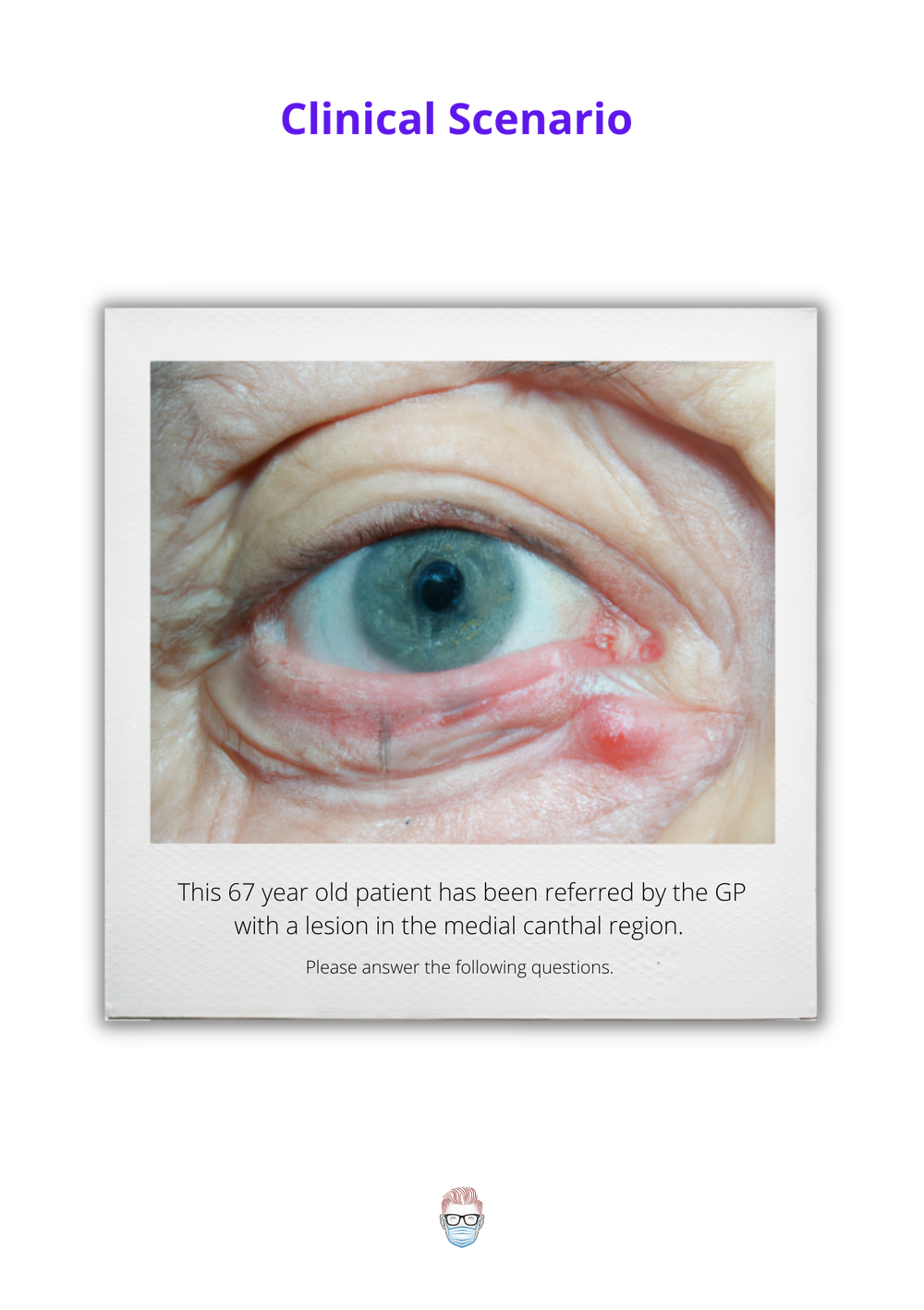 Periocular BCC - Clinical Case