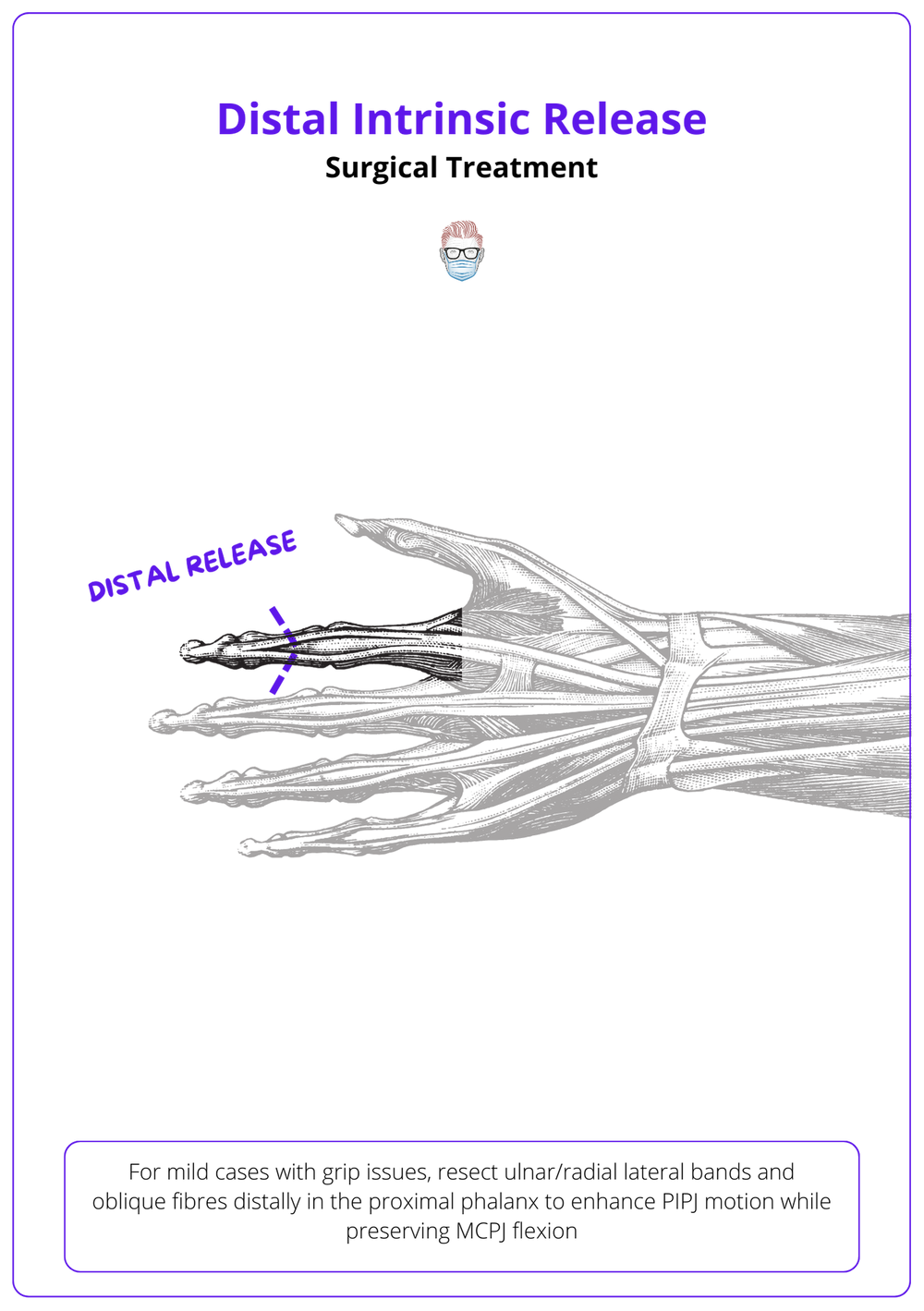 Intrinsic "Plus" Hand: Anatomy, Aetiology, and Management