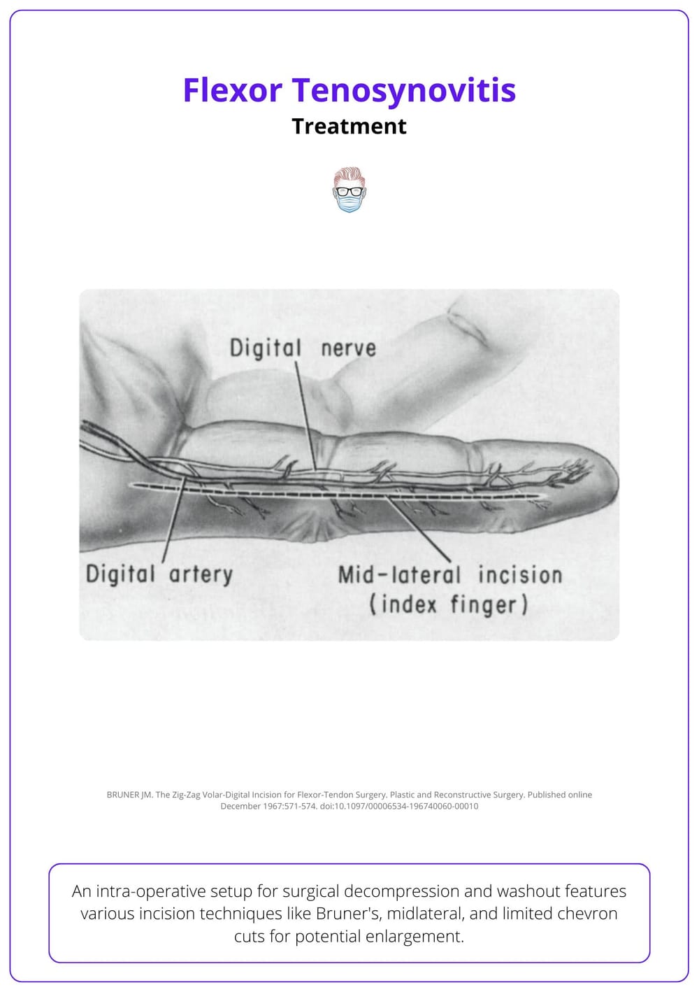 Pyogenic Flexor Tenosynovitis: Anatomy, Clinical View, & Treatment