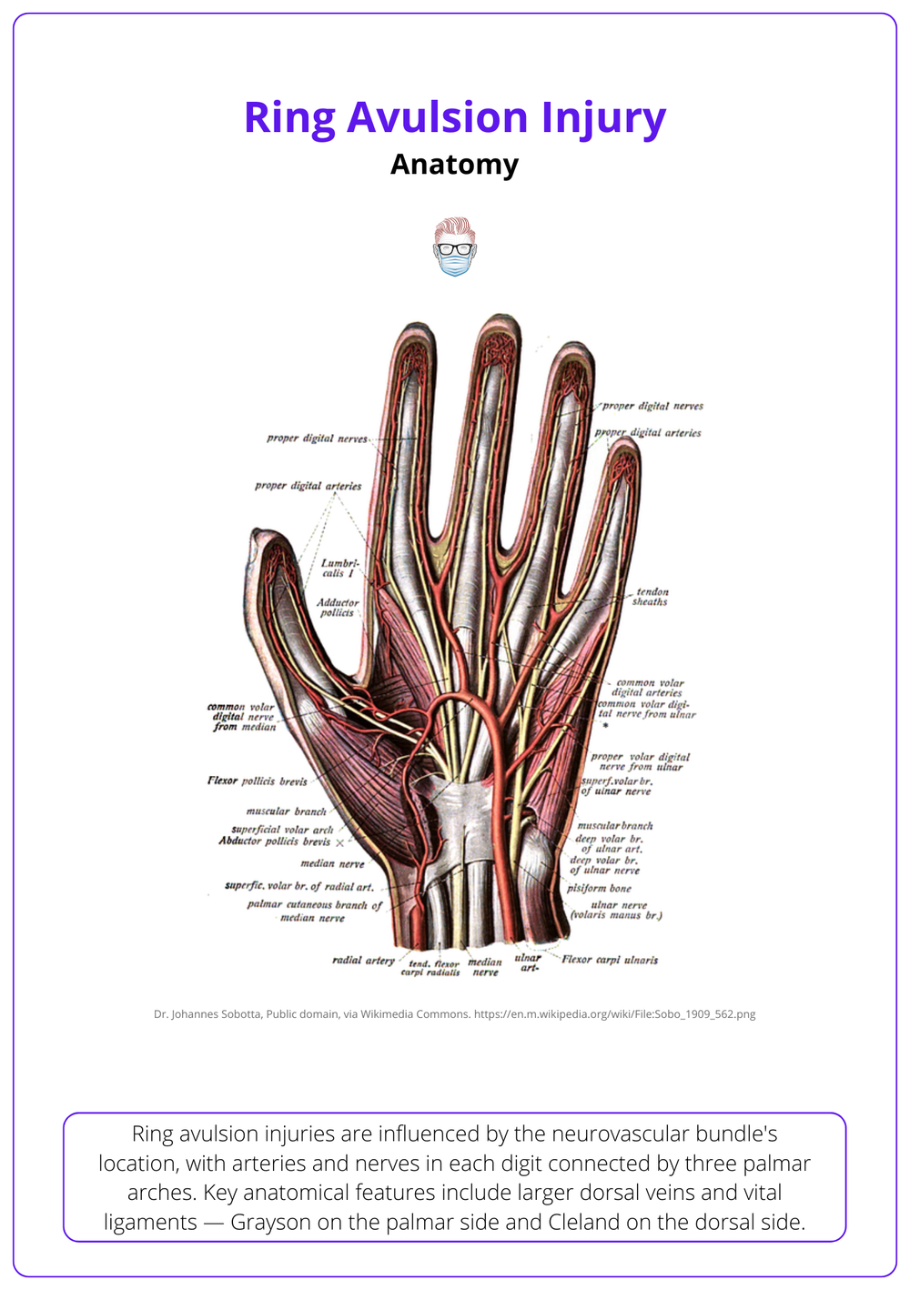 Ring Avulsion Injury: Mechanisms, Classification, & Management