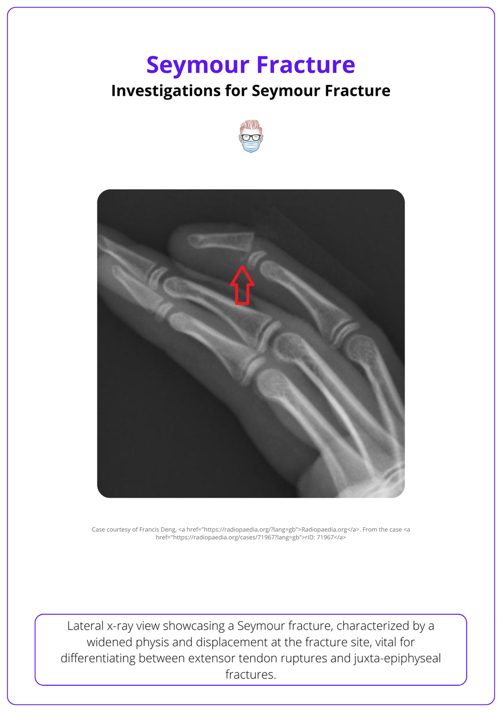 Seymour Fracture: Causes, Presentation, & Treatment