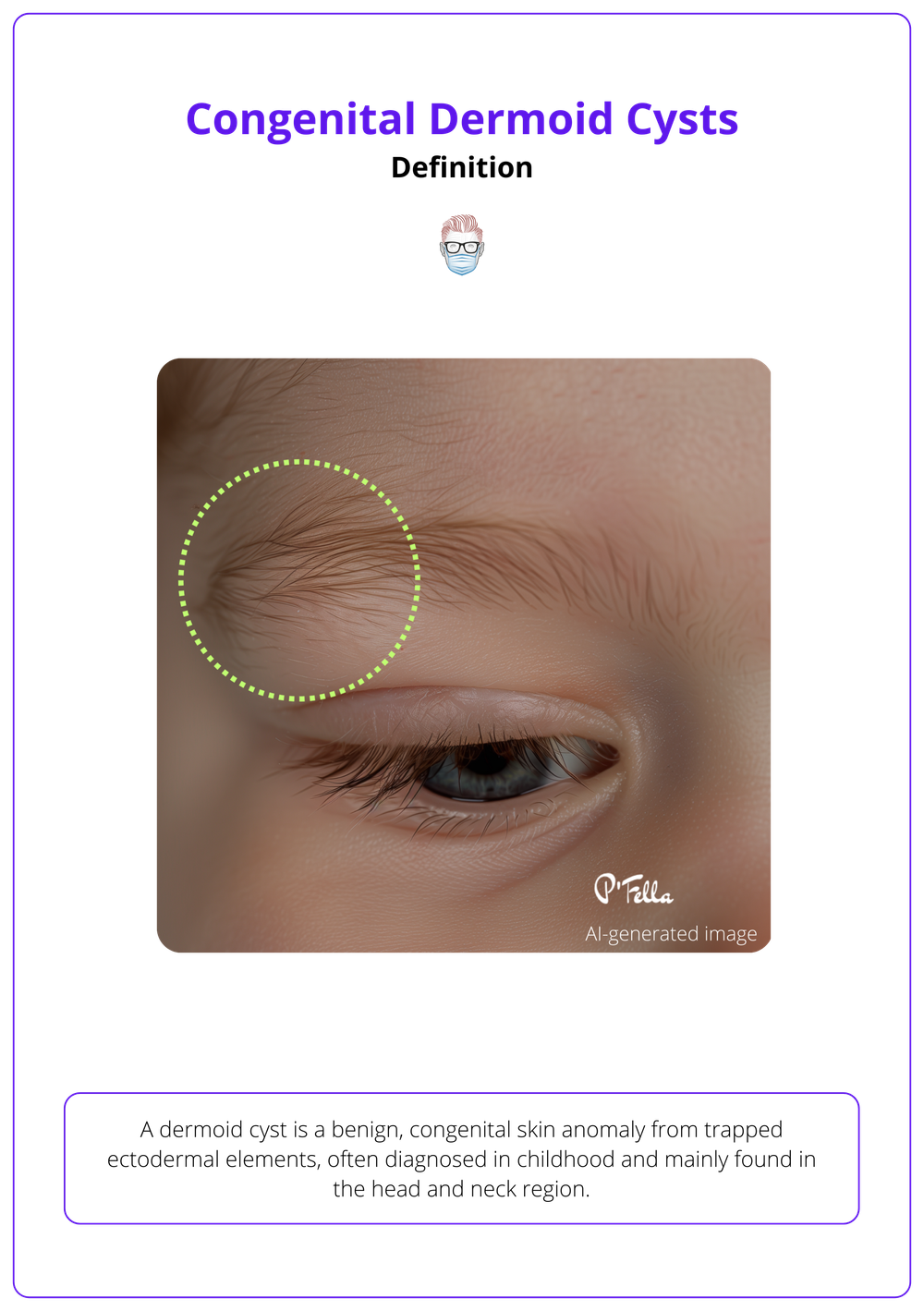 Congenital and Nasal Dermoid Cysts: Pathology, Presentation, & Treatment