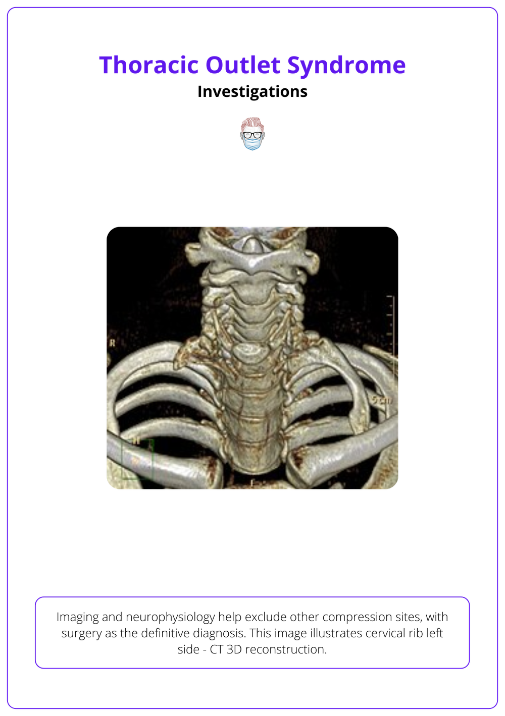 Thoracic Outlet Syndrome (TOS): Aetiology, Presentation, & Management