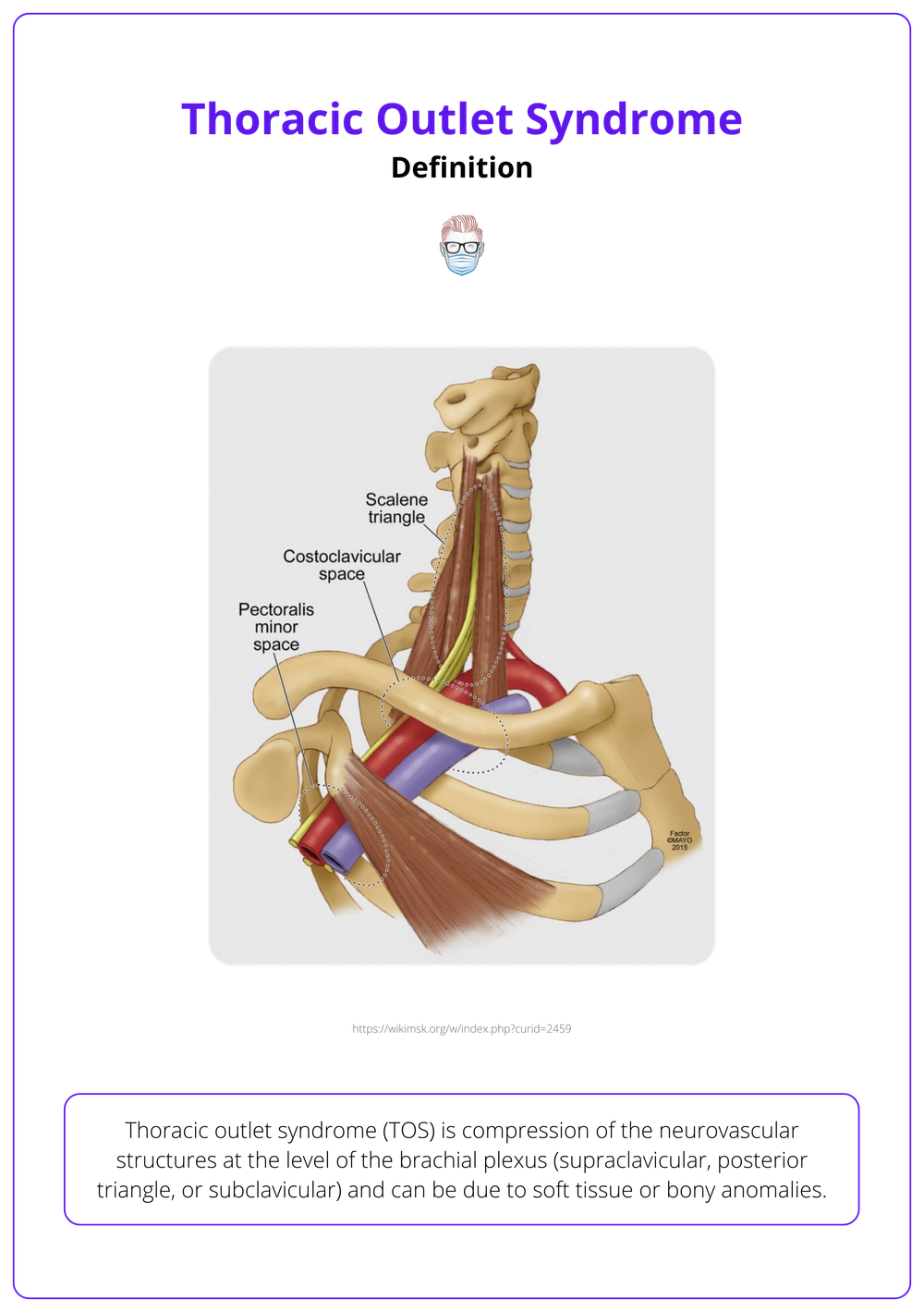 Thoracic Outlet Syndrome (TOS): Aetiology, Presentation, & Management