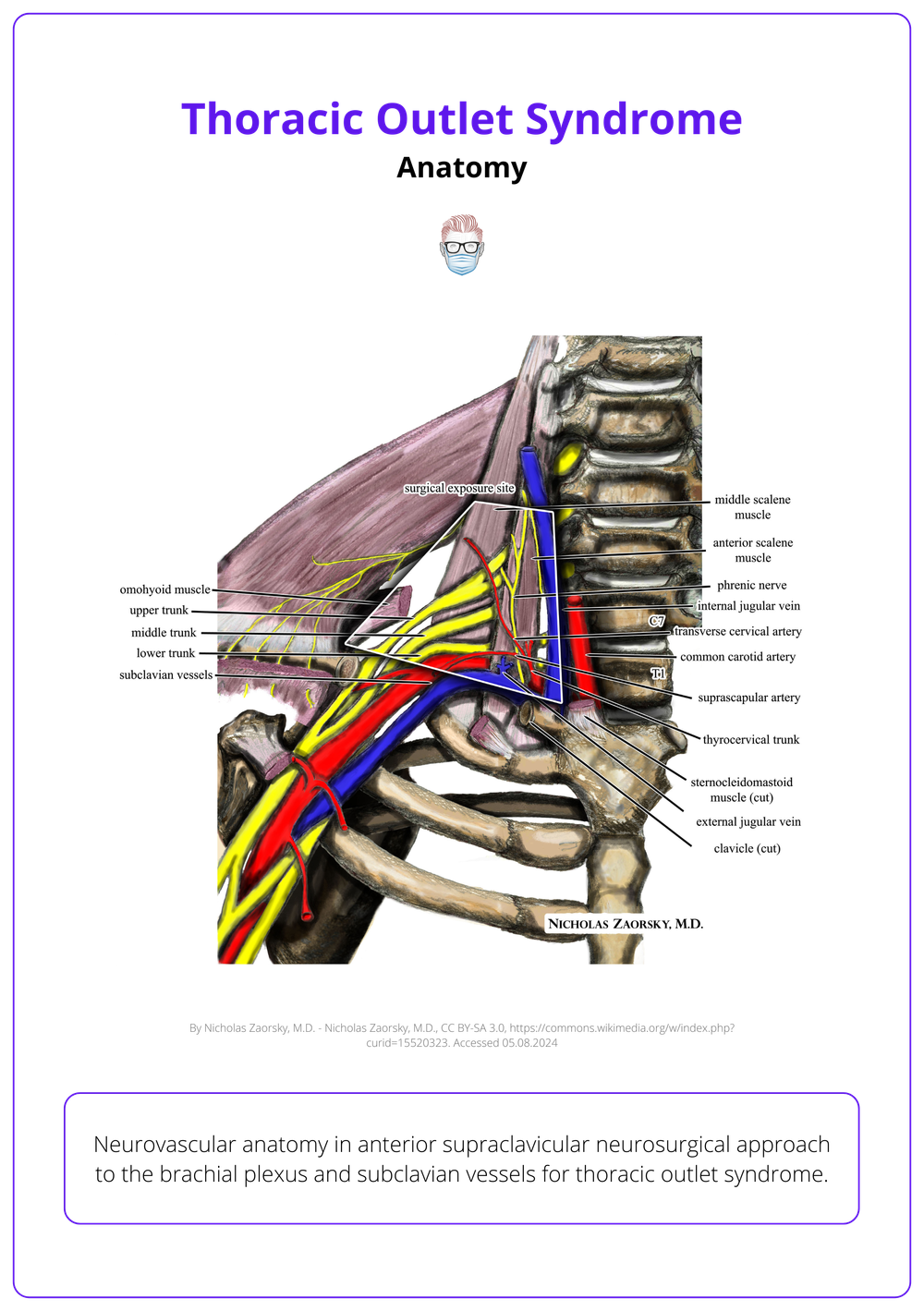 Thoracic Outlet Syndrome (TOS): Aetiology, Presentation, & Management