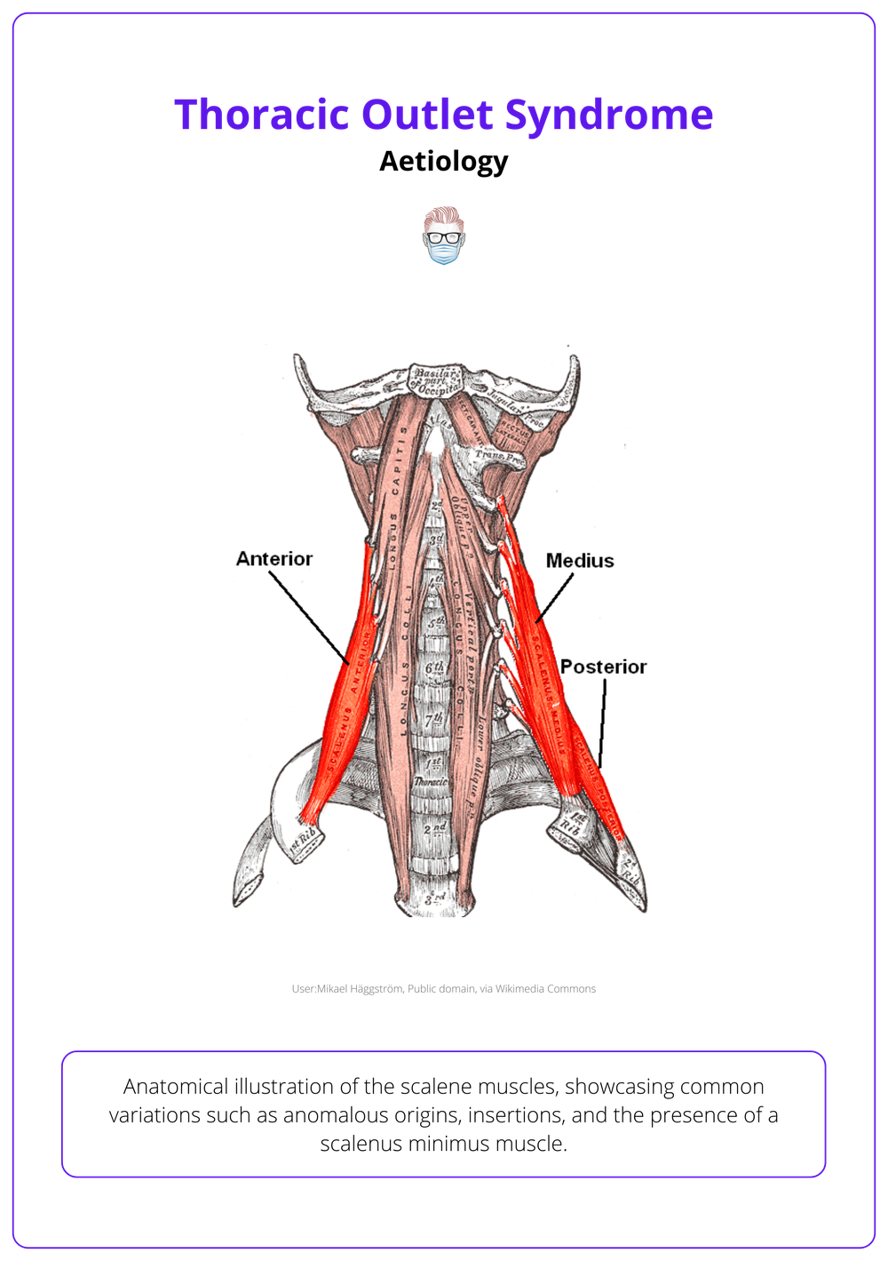 Thoracic Outlet Syndrome (TOS): Aetiology, Presentation, & Management