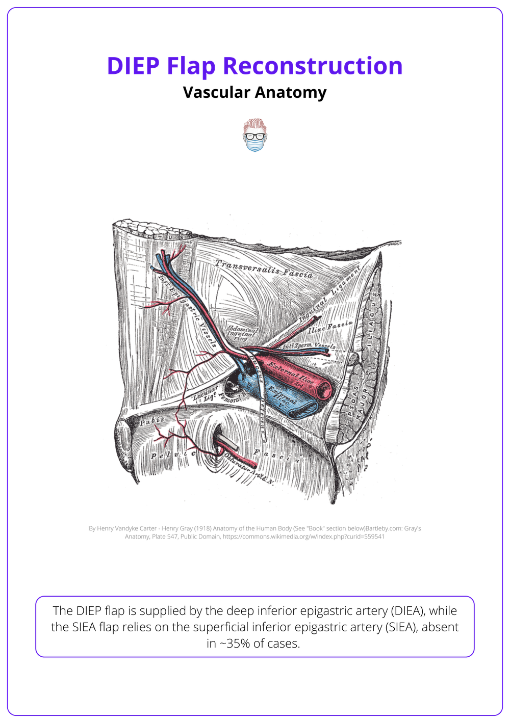 DIEP Flap Reconstruction: Anatomy, Key Surgical Steps, & Complications