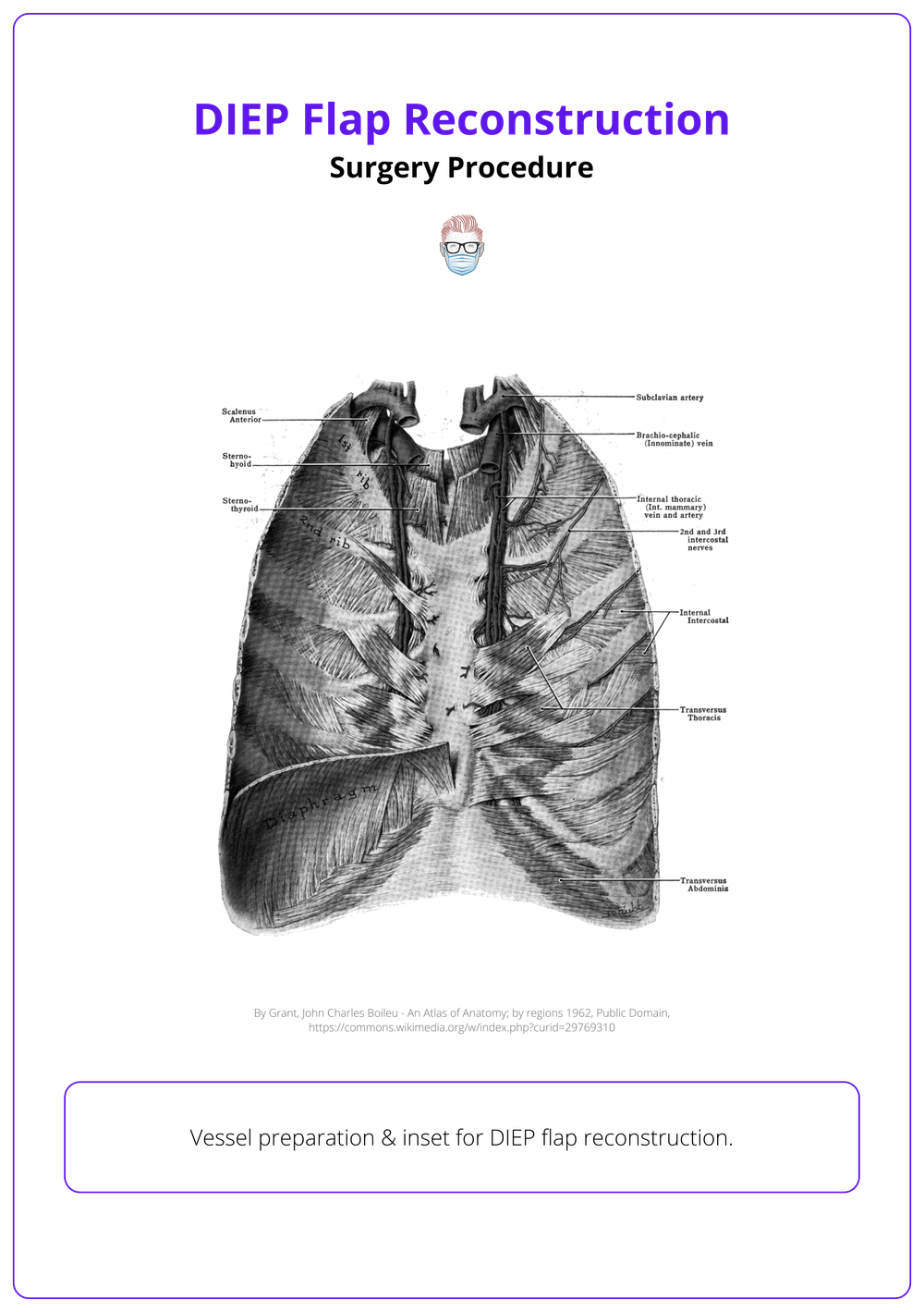 DIEP Flap Reconstruction: Anatomy, Key Surgical Steps, & Complications