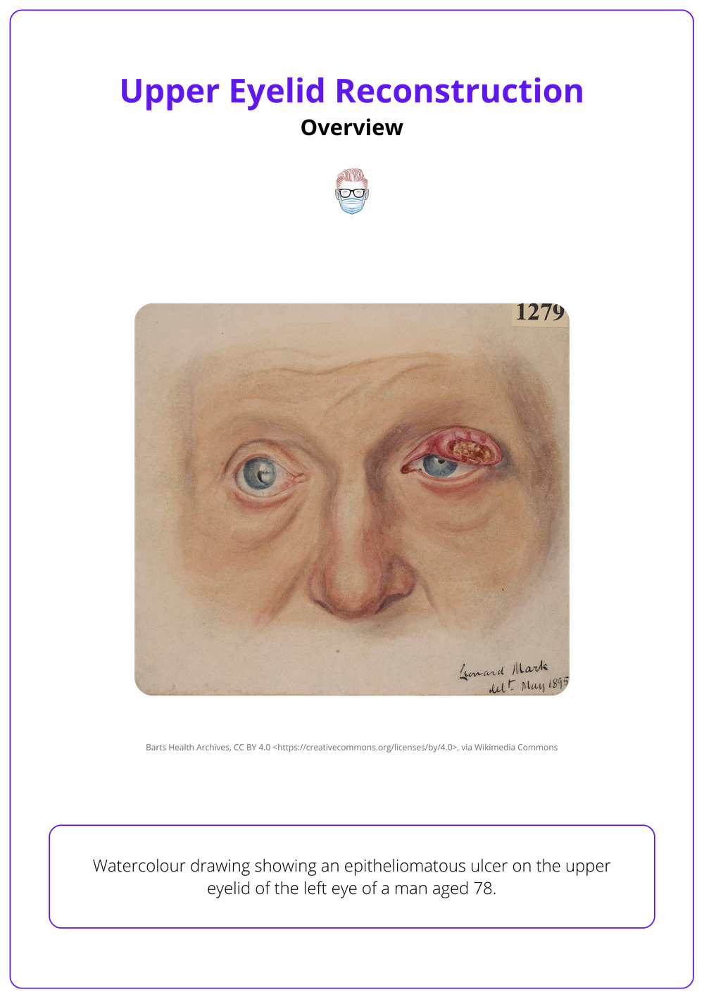 Upper Eyelid Reconstruction: Principles, Reconstruction Options ...