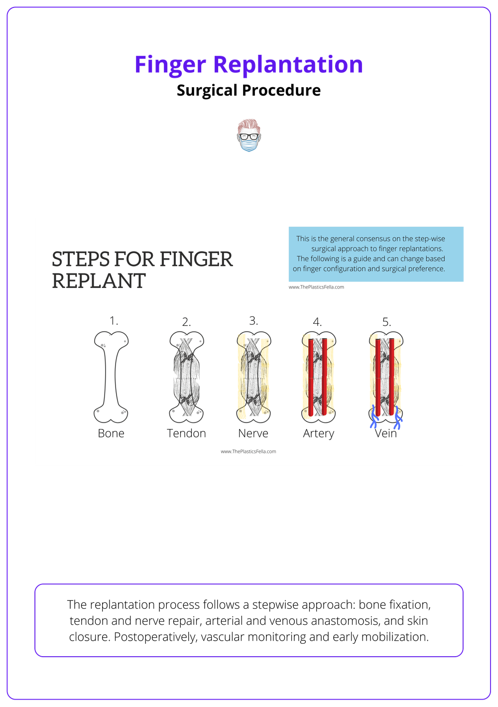 Finger Replantation: Indications, Surgical Technique, & Complications