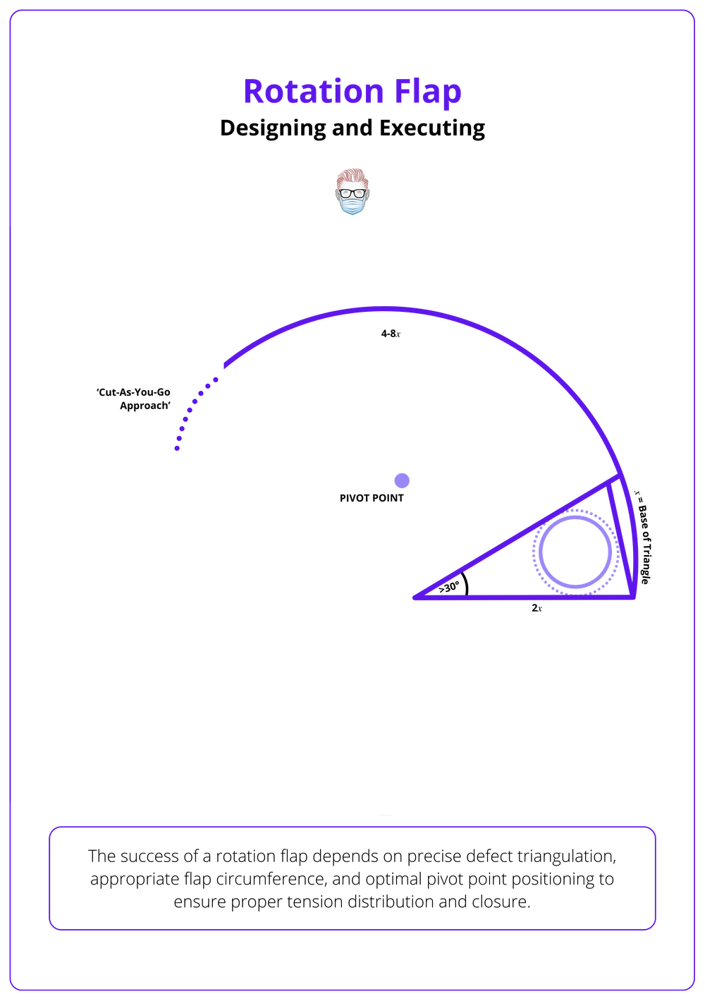Rotation Flap: Design Principles, Complications, & Flap Modifications