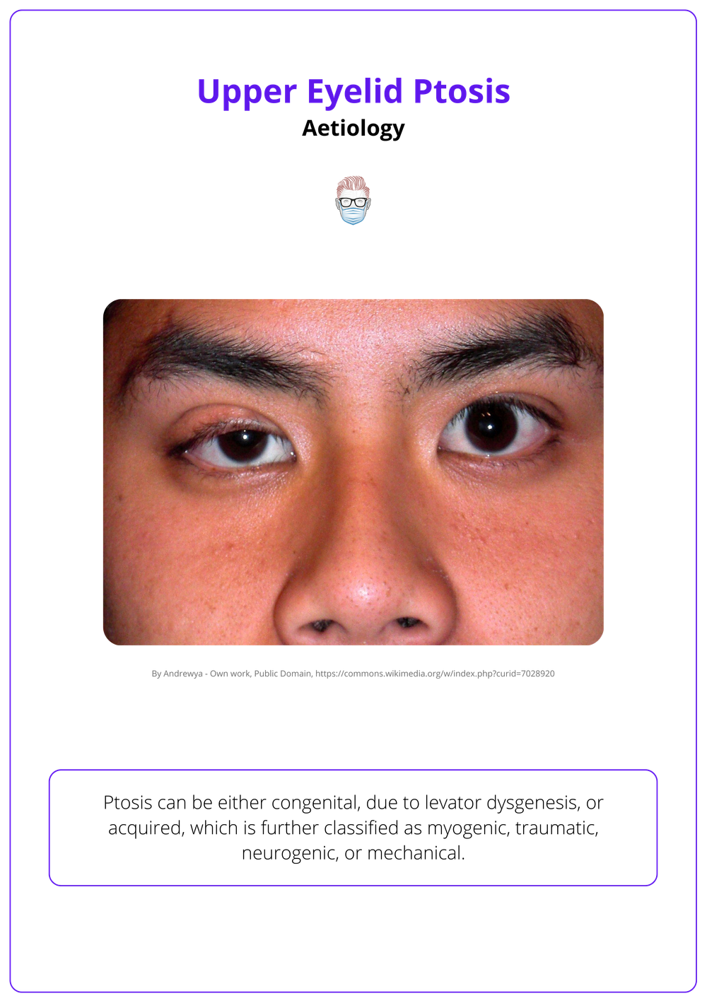 Upper Eyelid Ptosis: Classification, Diagnosis & Management