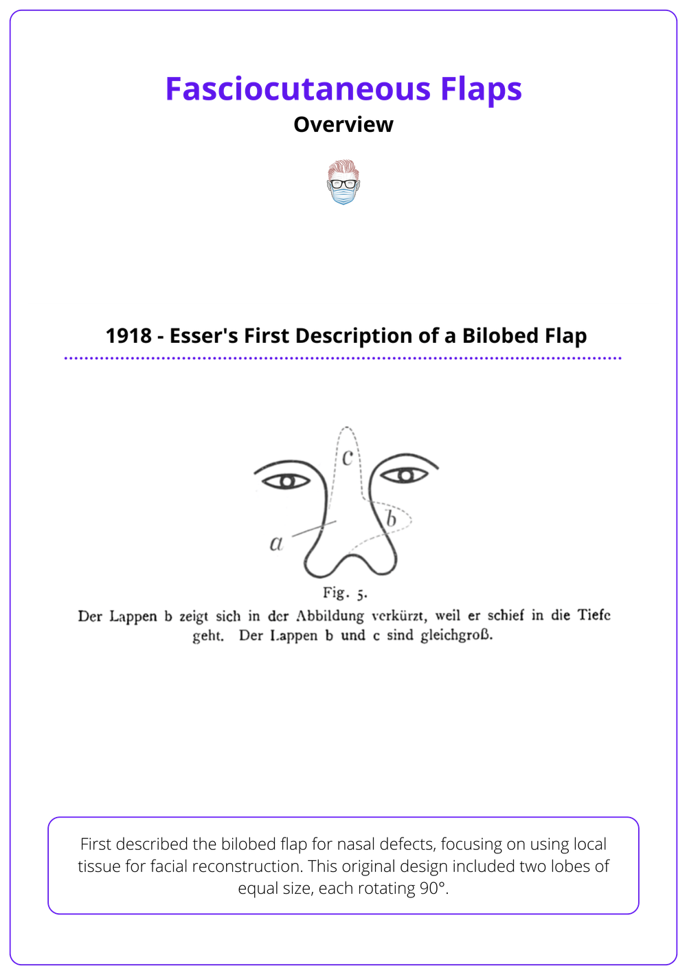 Bilobed Flaps: Indications, Flap Design, & Complications