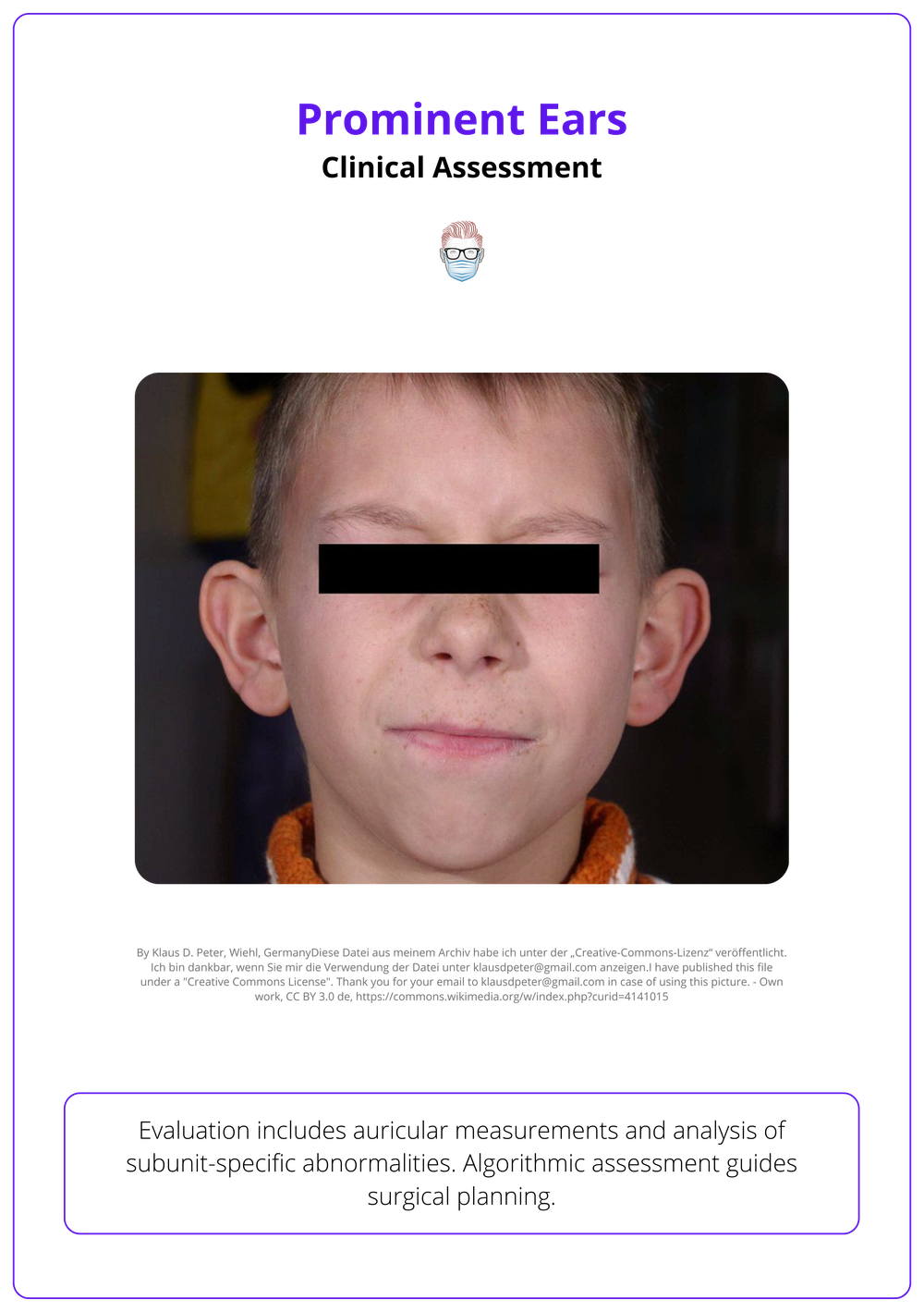 Prominent Ears: Anatomy, Clinical Assessment, & Correction via Otoplasty