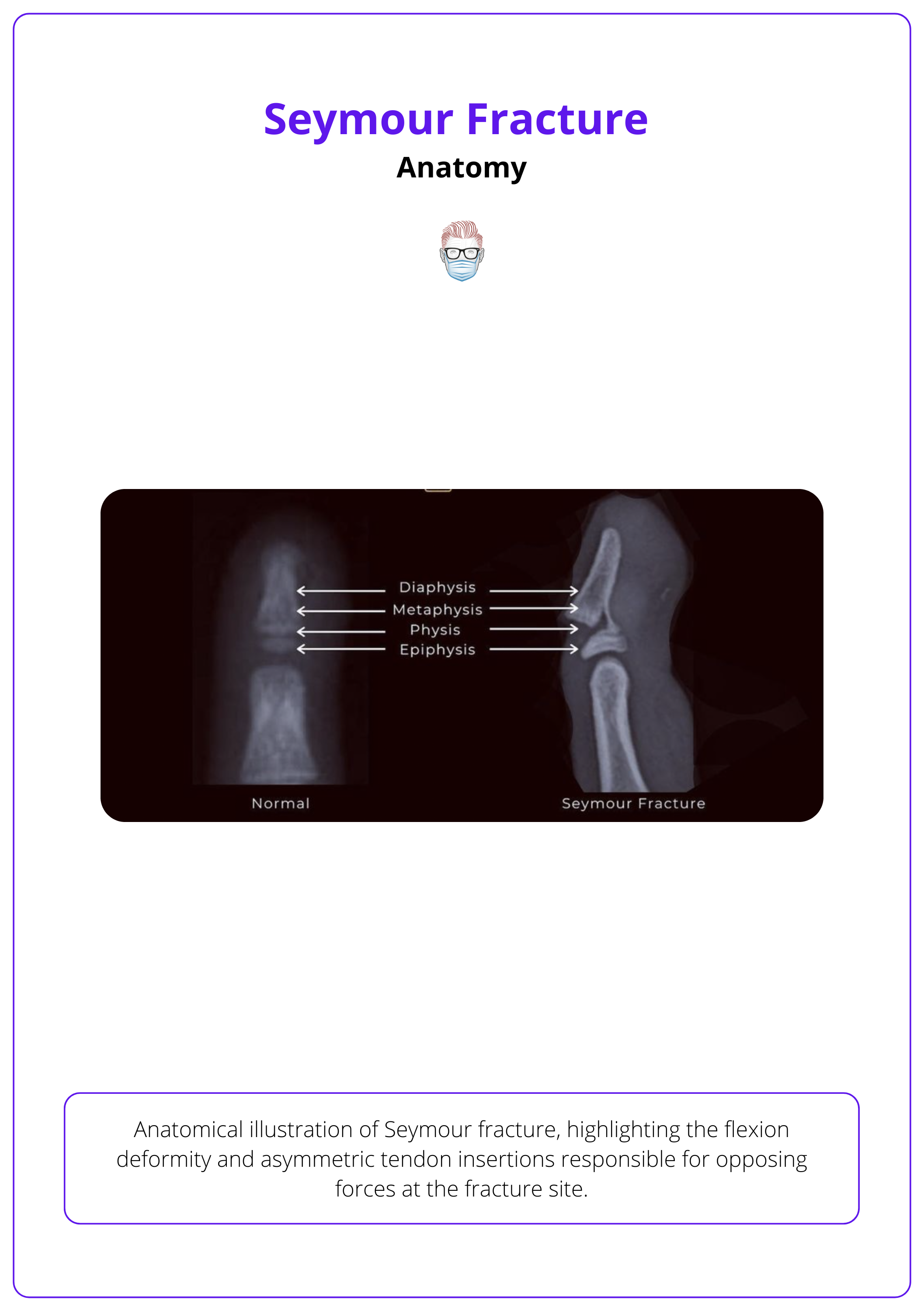 Seymour Fracture: Causes, Presentation, & Treatment