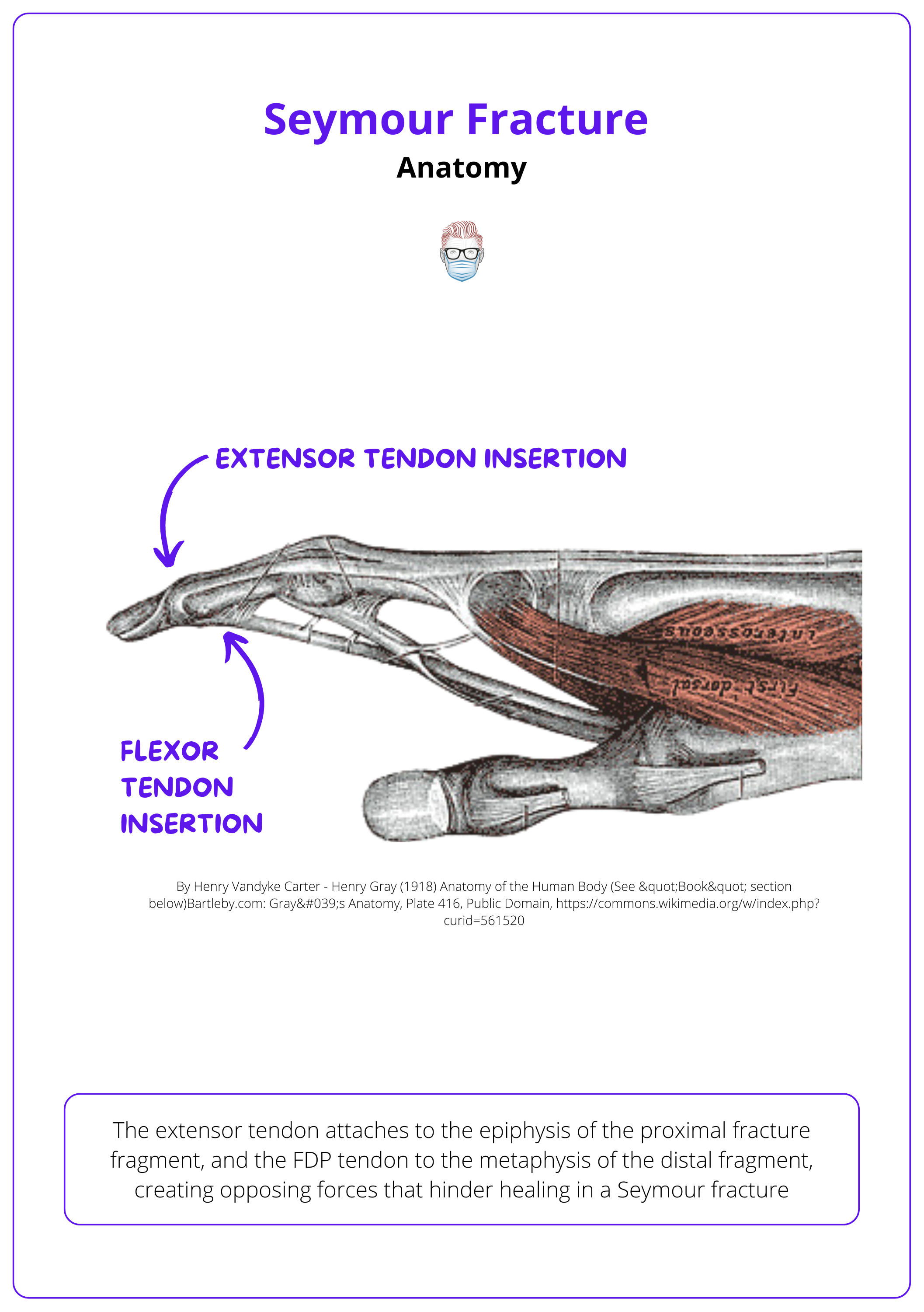 Seymour Fracture: Causes, Presentation, & Treatment