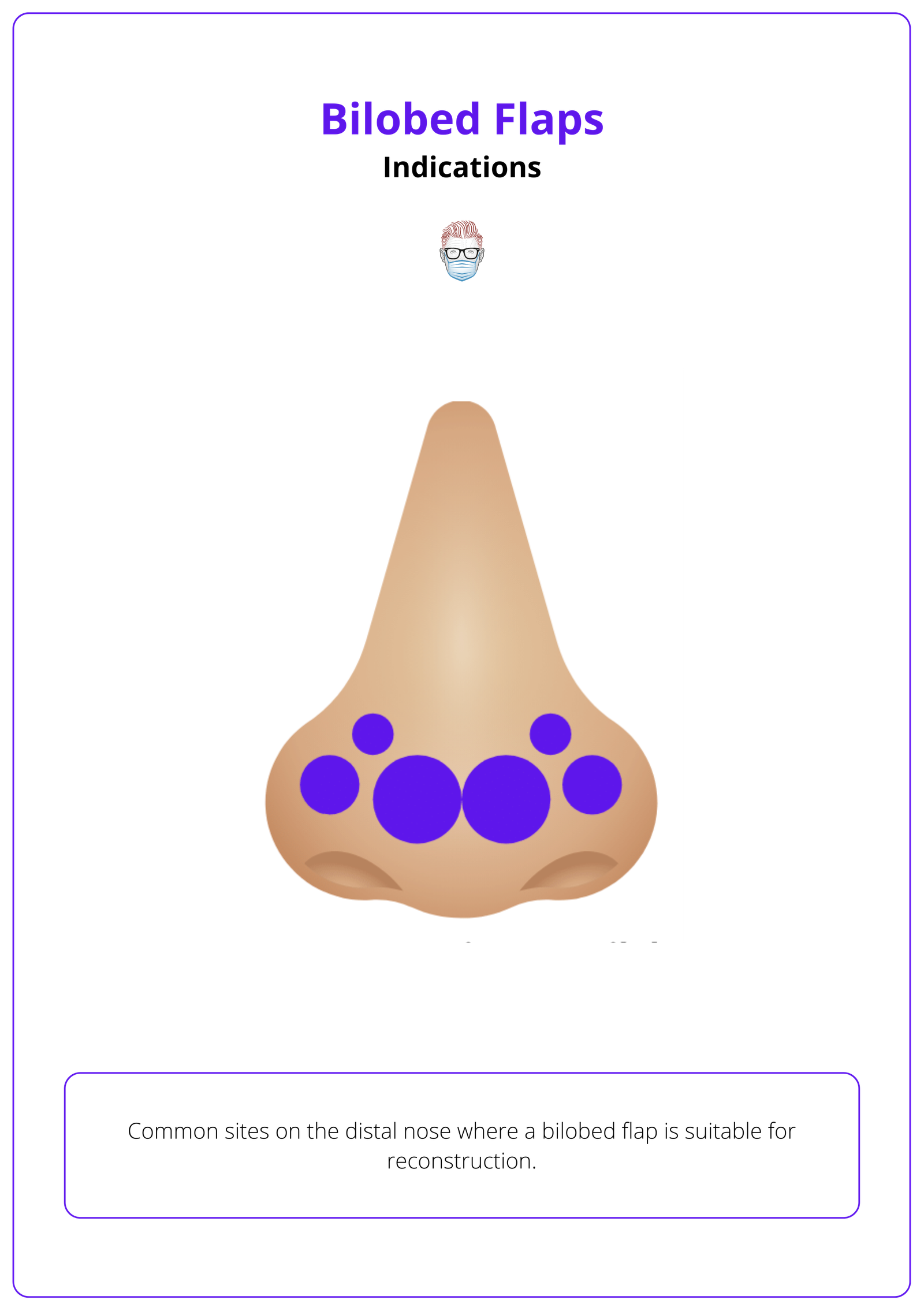 Bilobed Flaps: Indications, Flap Design, & Complications