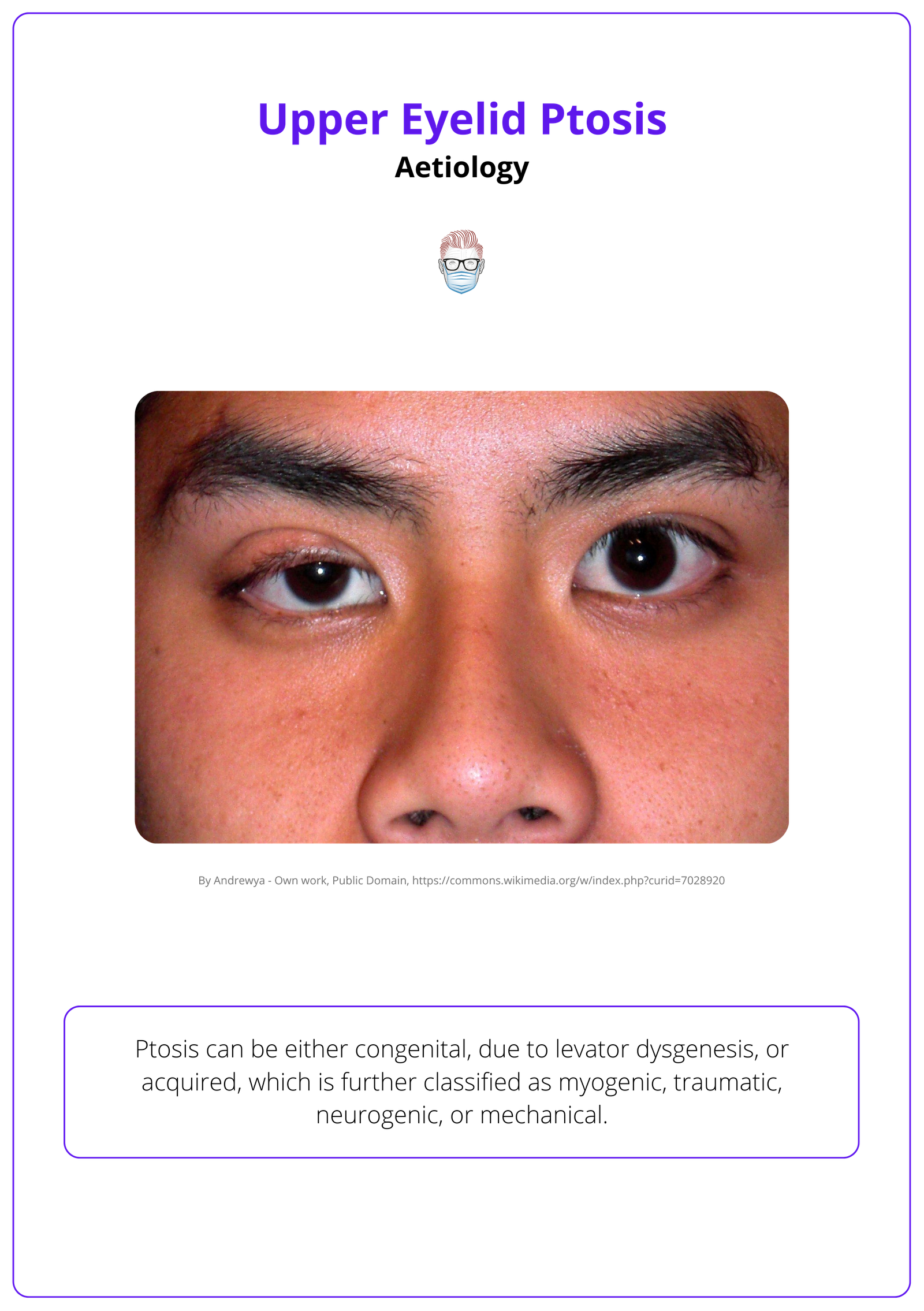 Upper Eyelid Ptosis: Classification, Diagnosis & Management