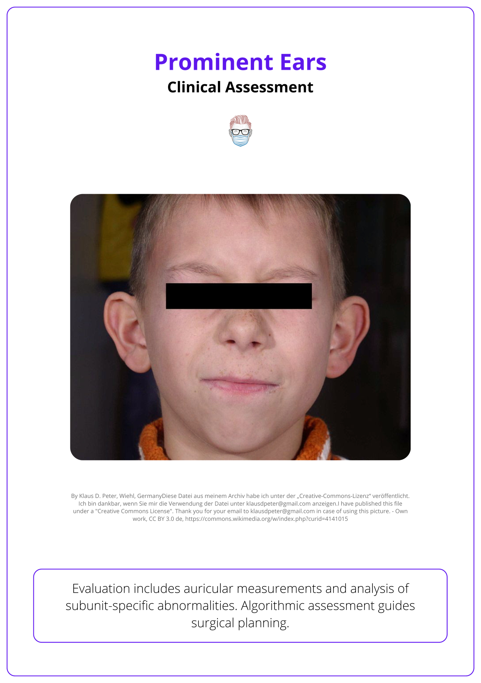 Prominent Ears: Anatomy, Clinical Assessment, & Correction via Otoplasty