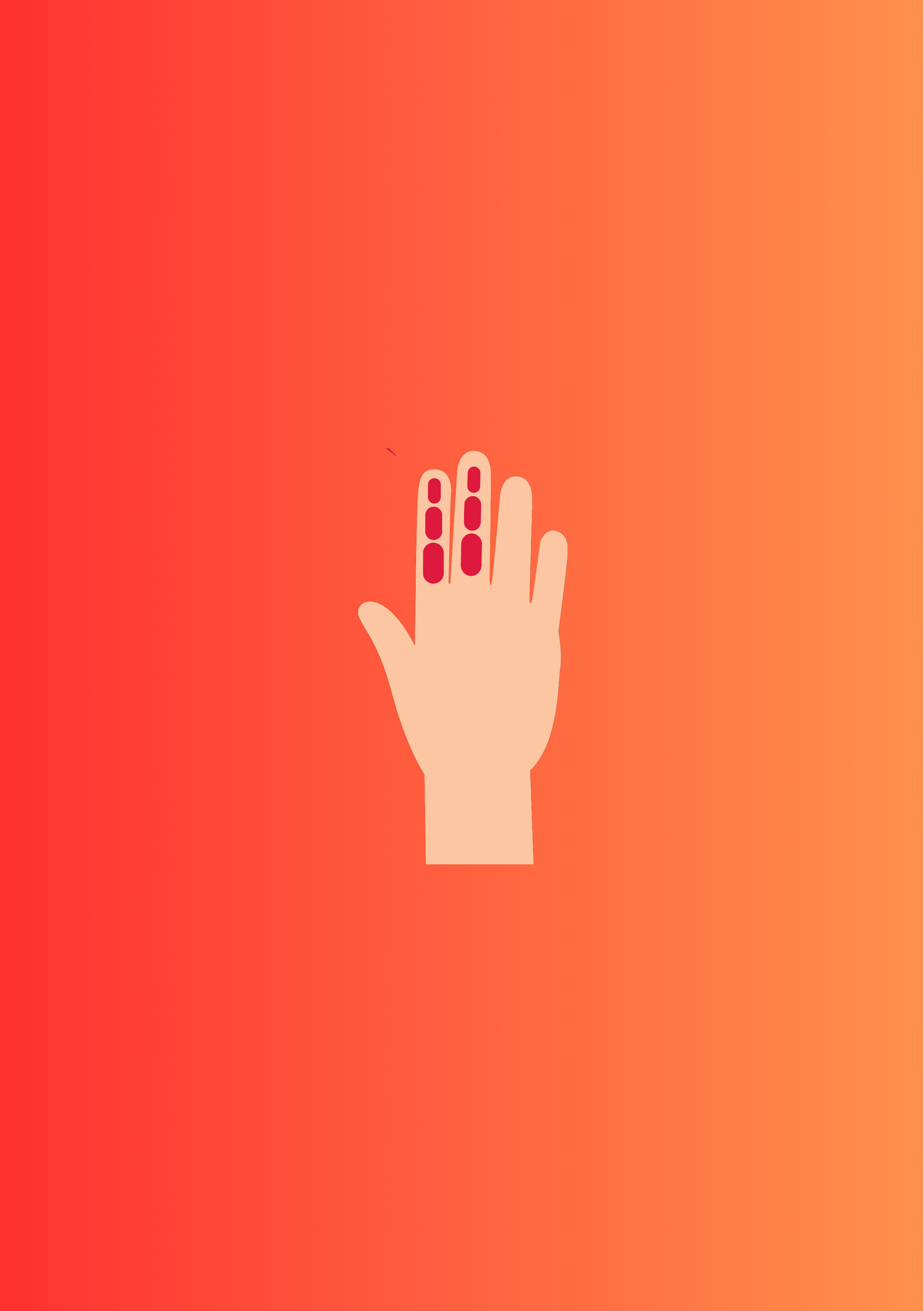 Macrodactyly: Aetiology, Investigations, & Management