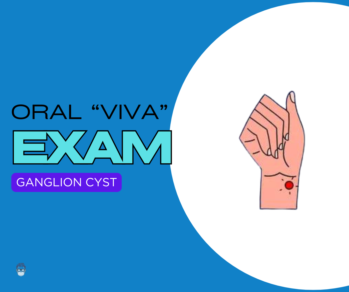 Ganglion Cyst Clinical Case