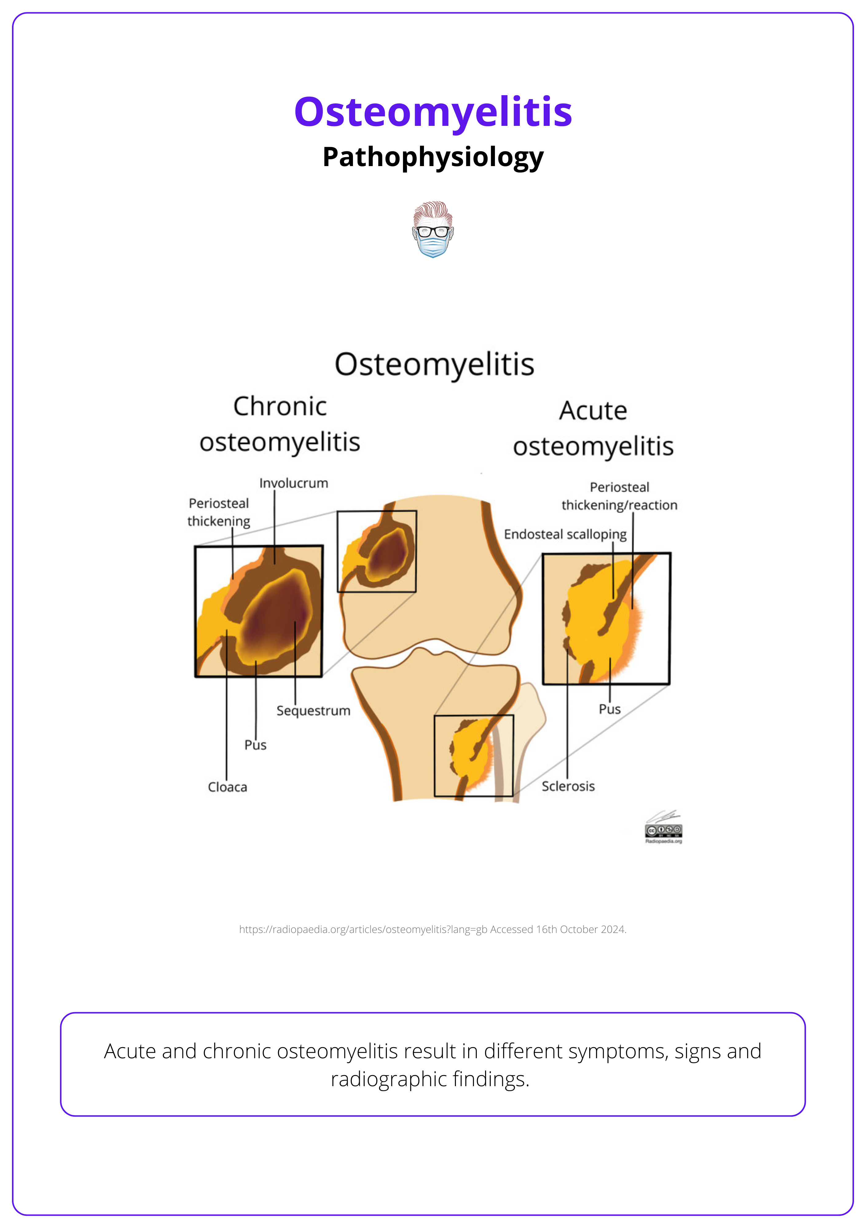 Osteomyelitis: Clinical Features, Investigations, Management