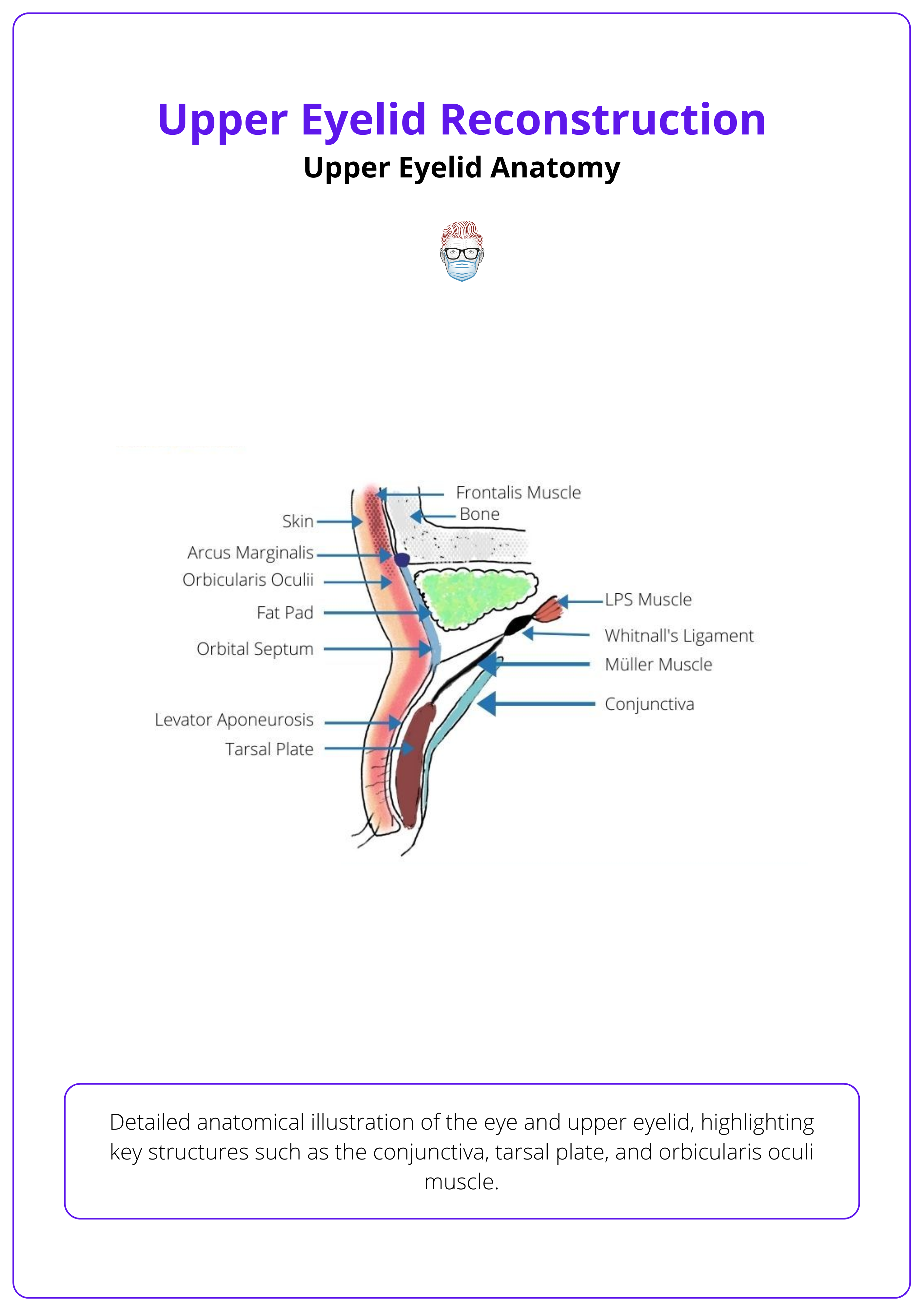 Upper Eyelid Reconstruction: Principles, Reconstruction Options ...