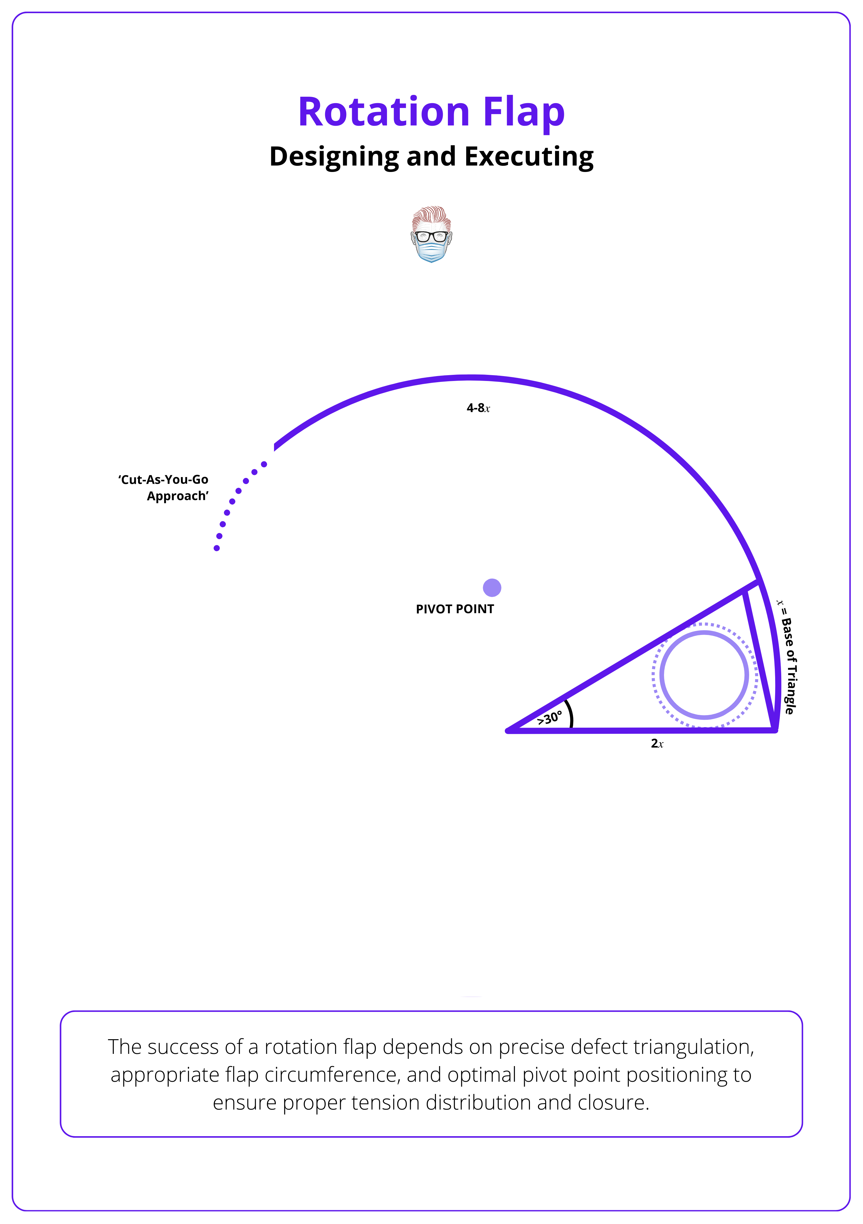 Rotation Flap: Design Principles, Complications, & Flap Modifications