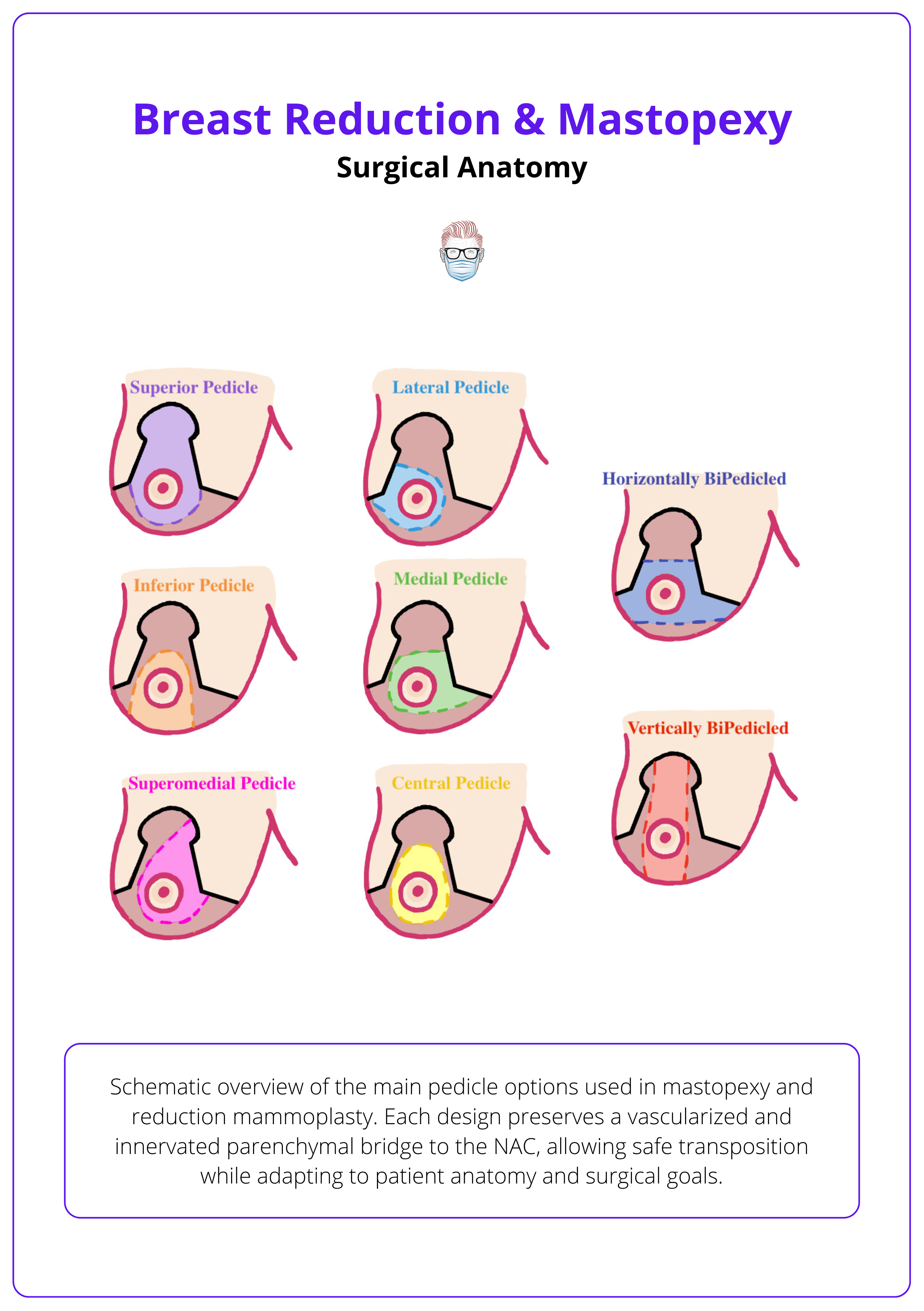 Breast Reduction and Mastopexy: Anatomy, Techniques, & Complications